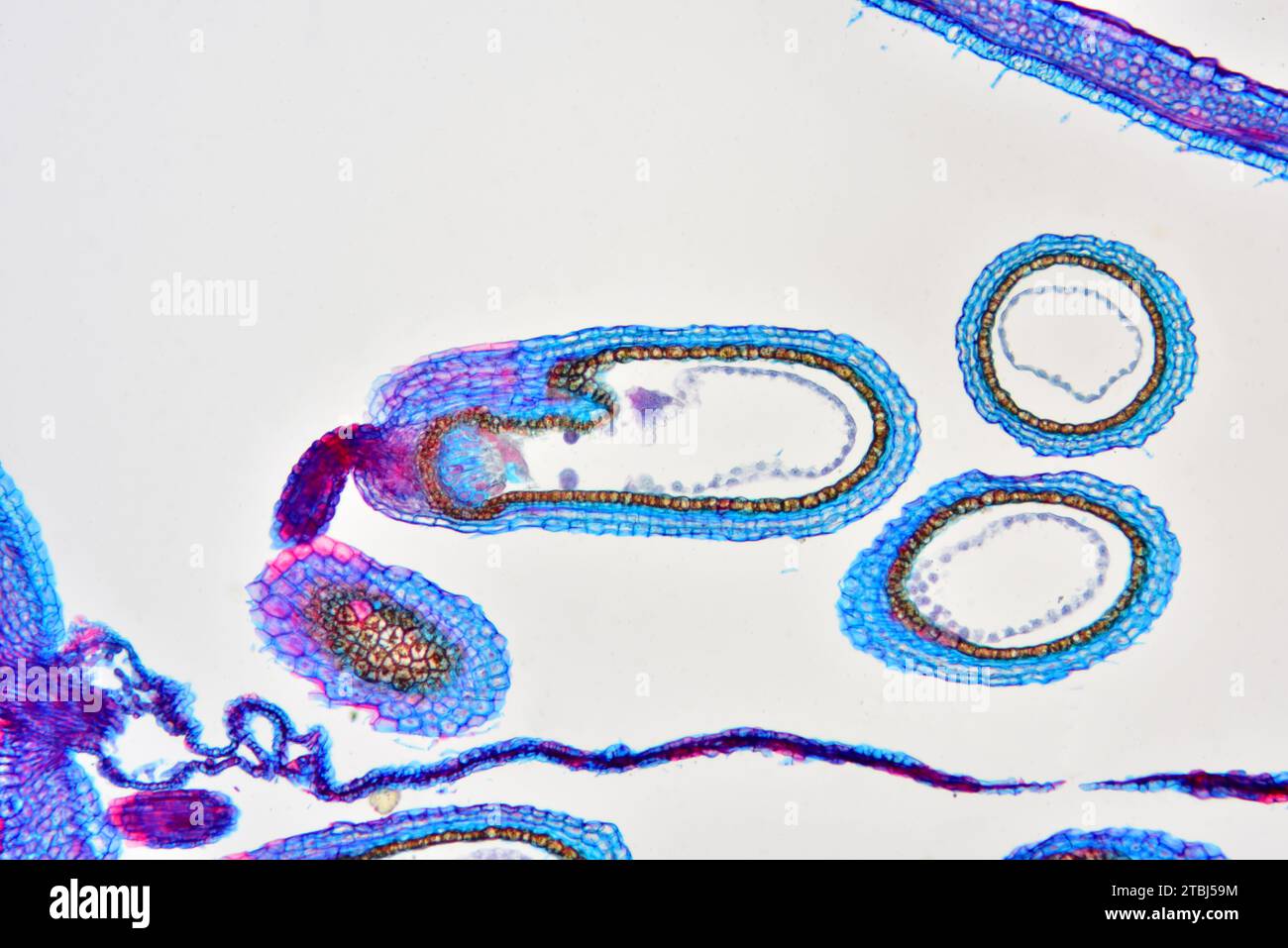 Ovary with embryos of shepherd purse (Capsella bursa-pastoris). Optical ...