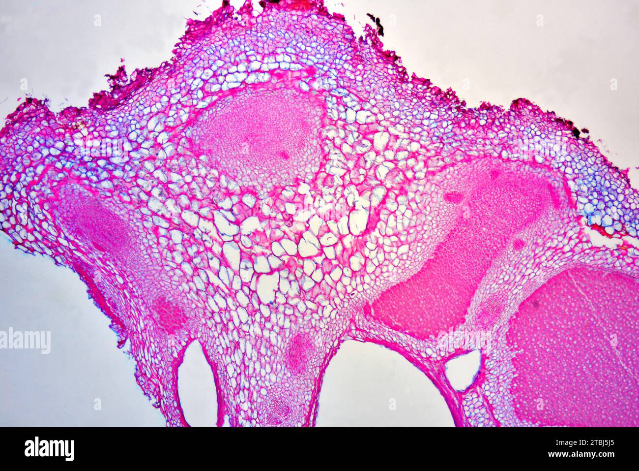 Lupinus root (cross section) with Rhizobium radicicola, fix nitrogen ...