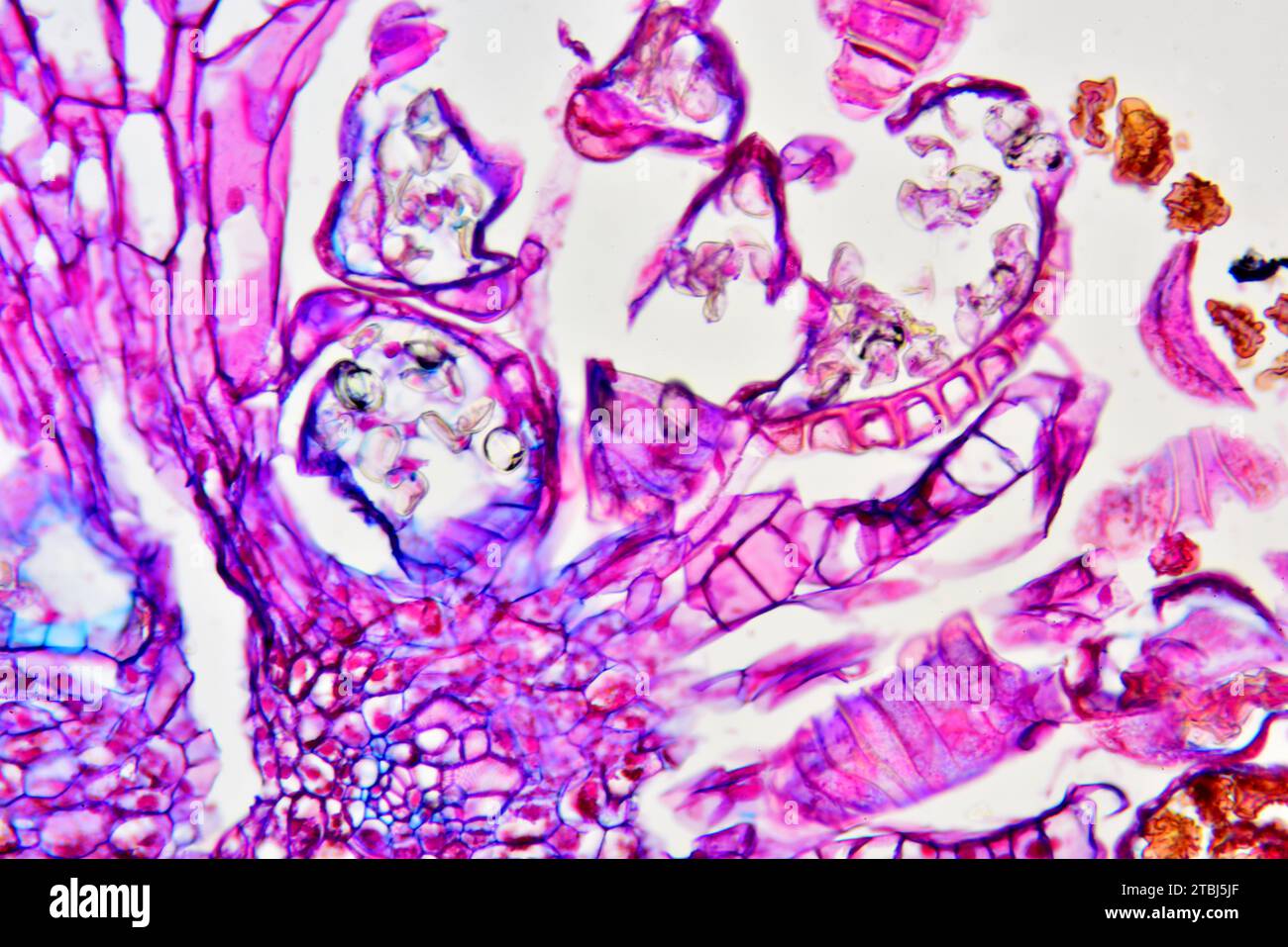 Sorus with sporangia of fern Aspidium sp. Optical microscope X200 Stock ...