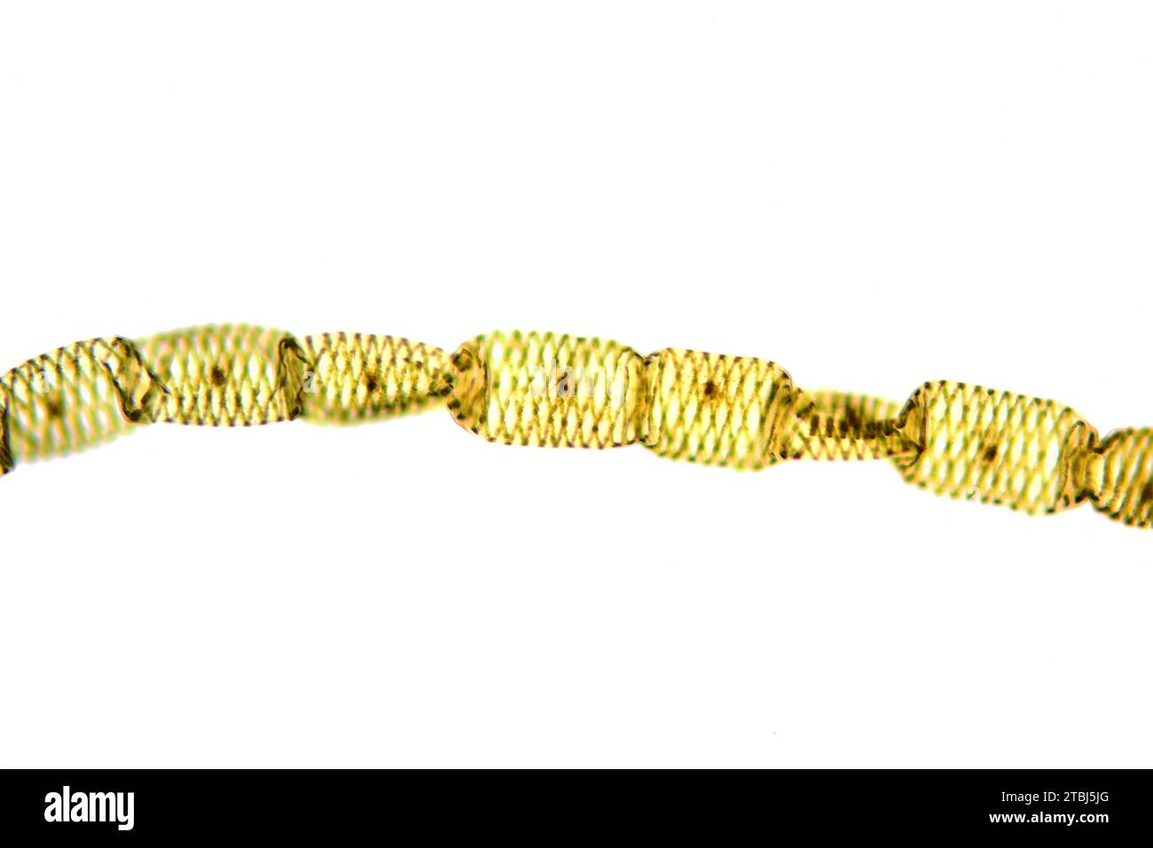 Water silk (Spirogyra sp.) with helical chloroplasts. Optical ...