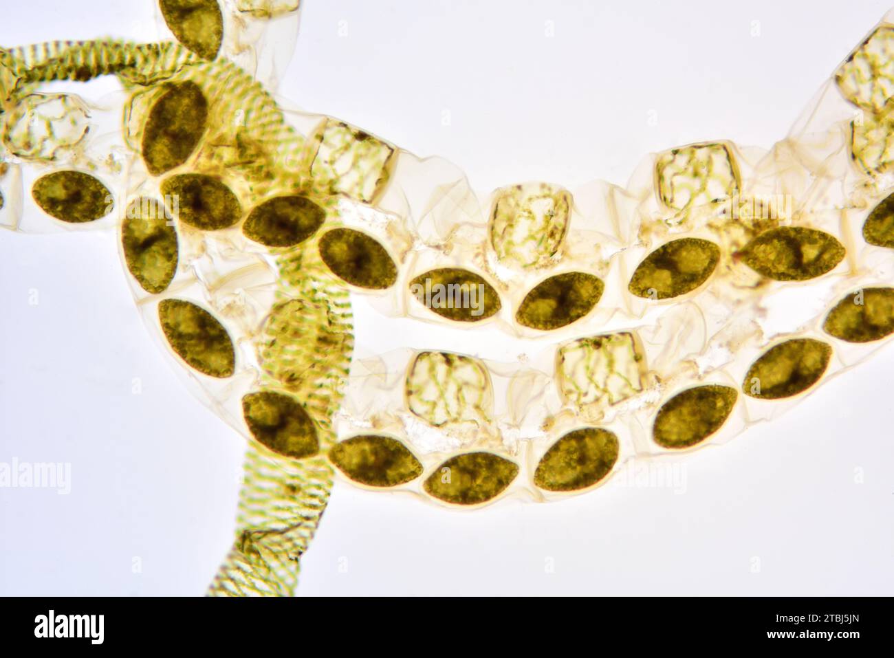 Spirogyra Conjugation Under Microscope