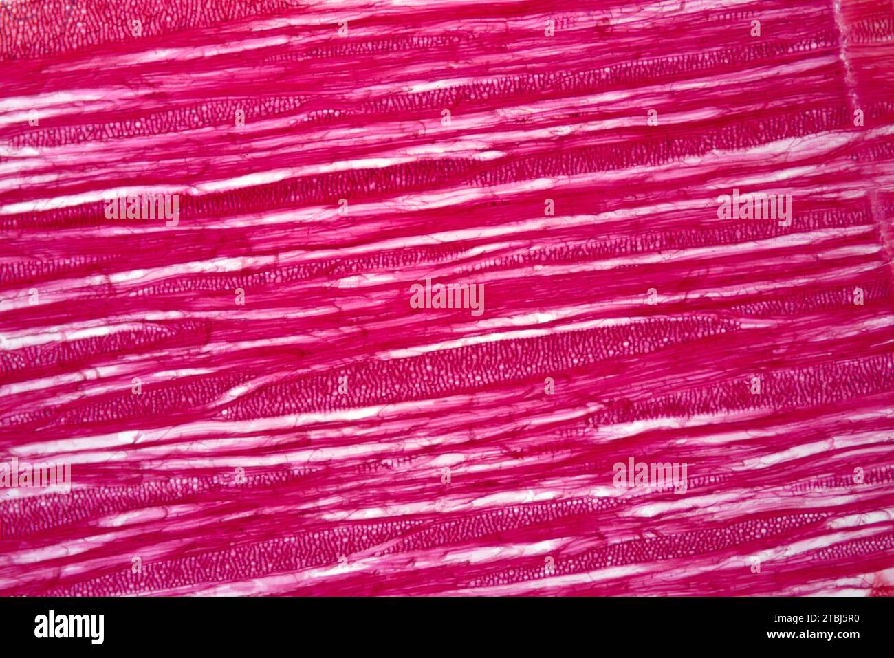 Tracheids, a kind of xylem. Optical microscope X40 Stock Photo - Alamy