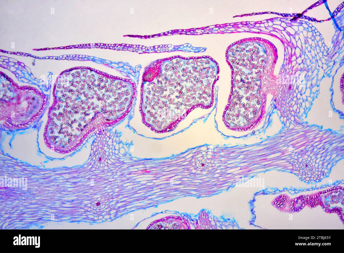 Lycopodium, sporophylls and spores. Optical microscope X40 Stock Photo ...