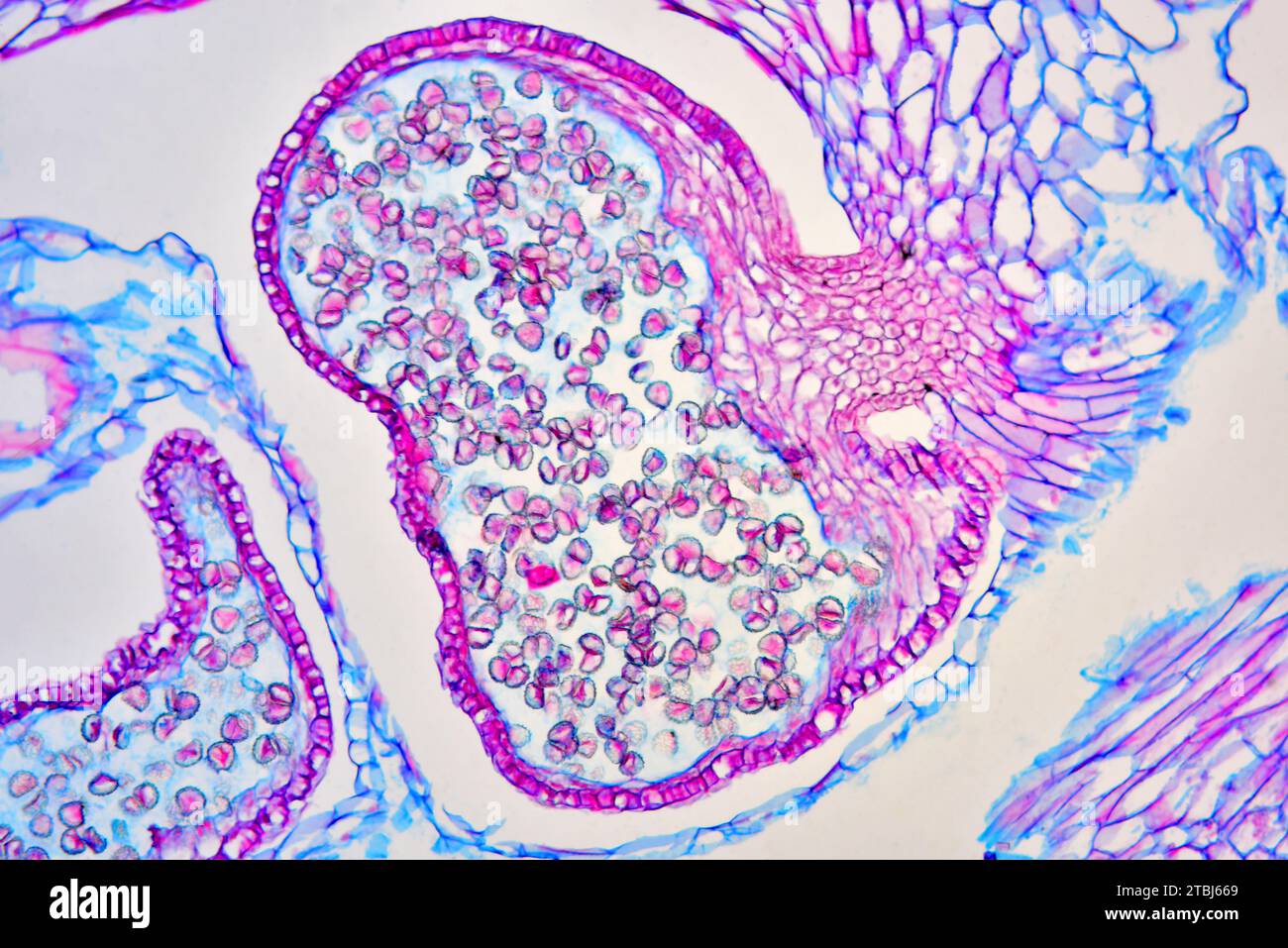 Lycopodium, sporophylls and spores. Optical microscope X100 Stock Photo ...