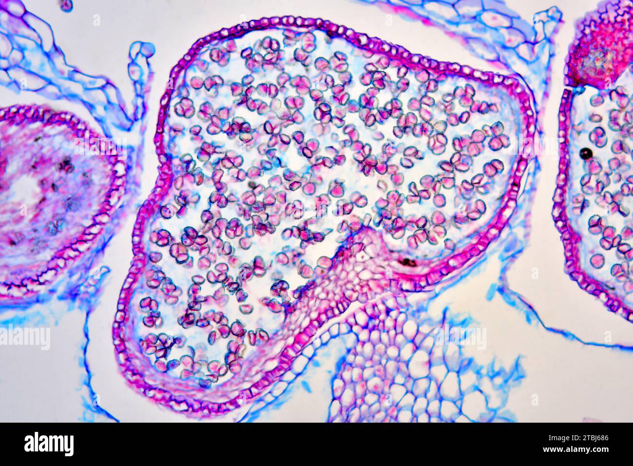 Lycopodium, sporophylls and spores. Optical microscope X100 Stock Photo ...