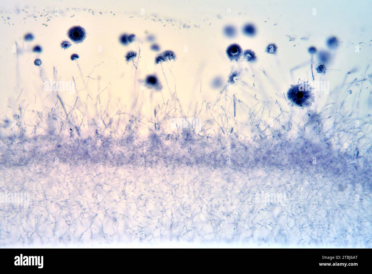 Conidia of Aspergillus, an ascomycota fungi. Optical microscope X100 Stock Photo - Alamy