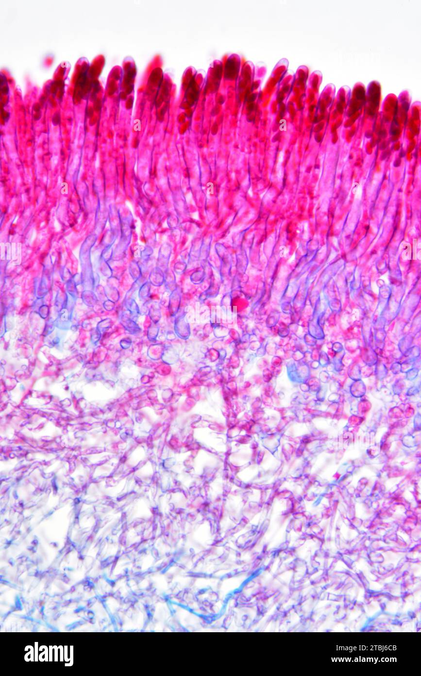 Asci with ascospores of morel mushroom (Morchella sp.). Optical ...