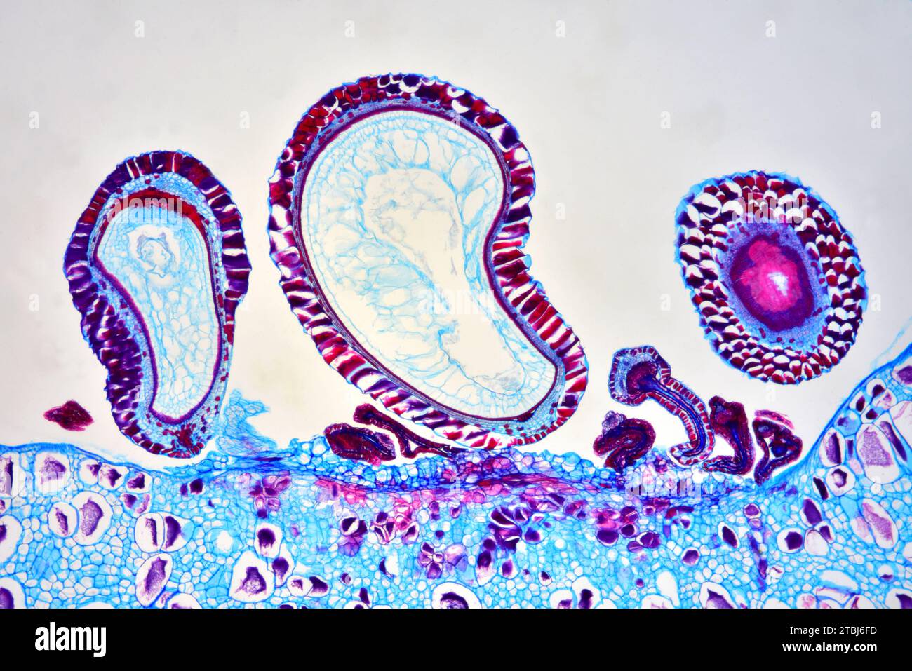 Gooseberry (Ribes sp.) young fruit. Optical microscope X100 Stock Photo ...