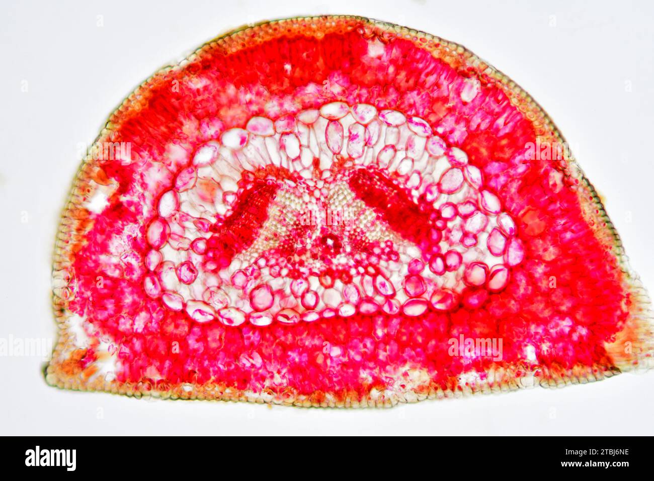 Leaf cross section of pine (Pinus sp.) showing endodermis, epidermis ...