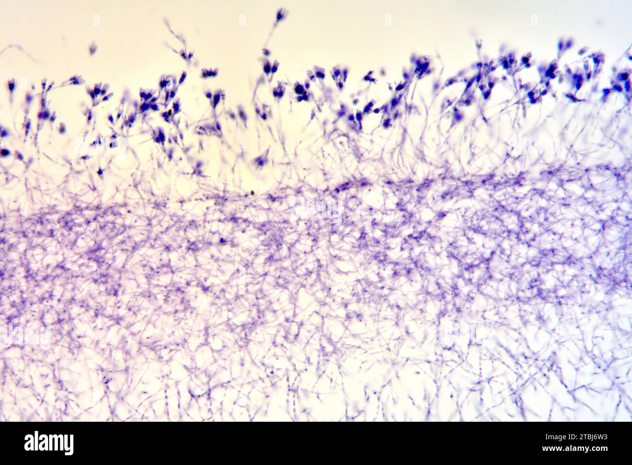 Hyphae of Penicillium with conidia. Optical microscope X200 Stock Photo ...
