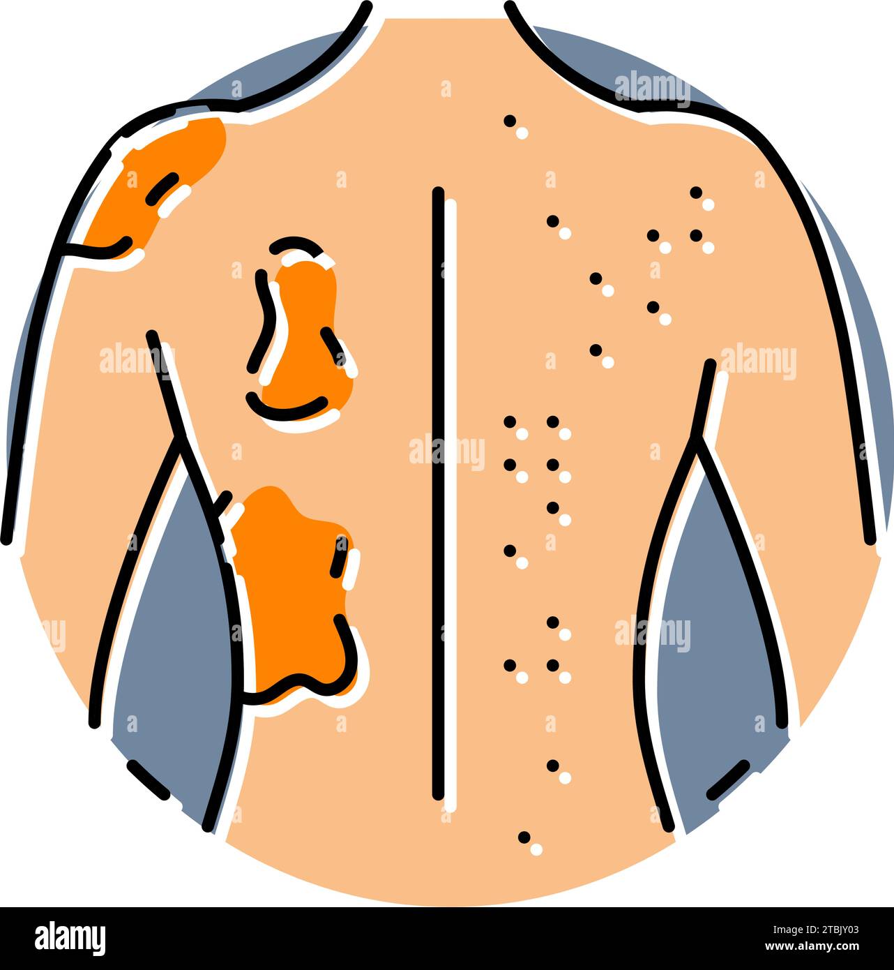 rash skin lesions disease symptom color icon vector illustration Stock ...