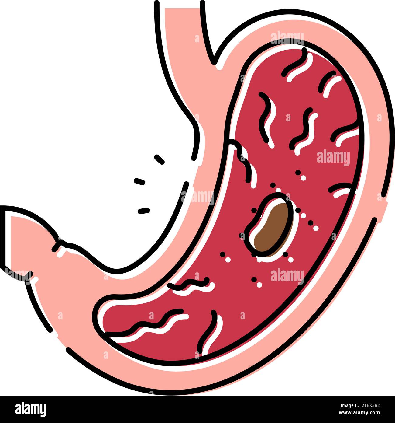 gastric ulcer gastroenterologist color icon vector illustration Stock ...