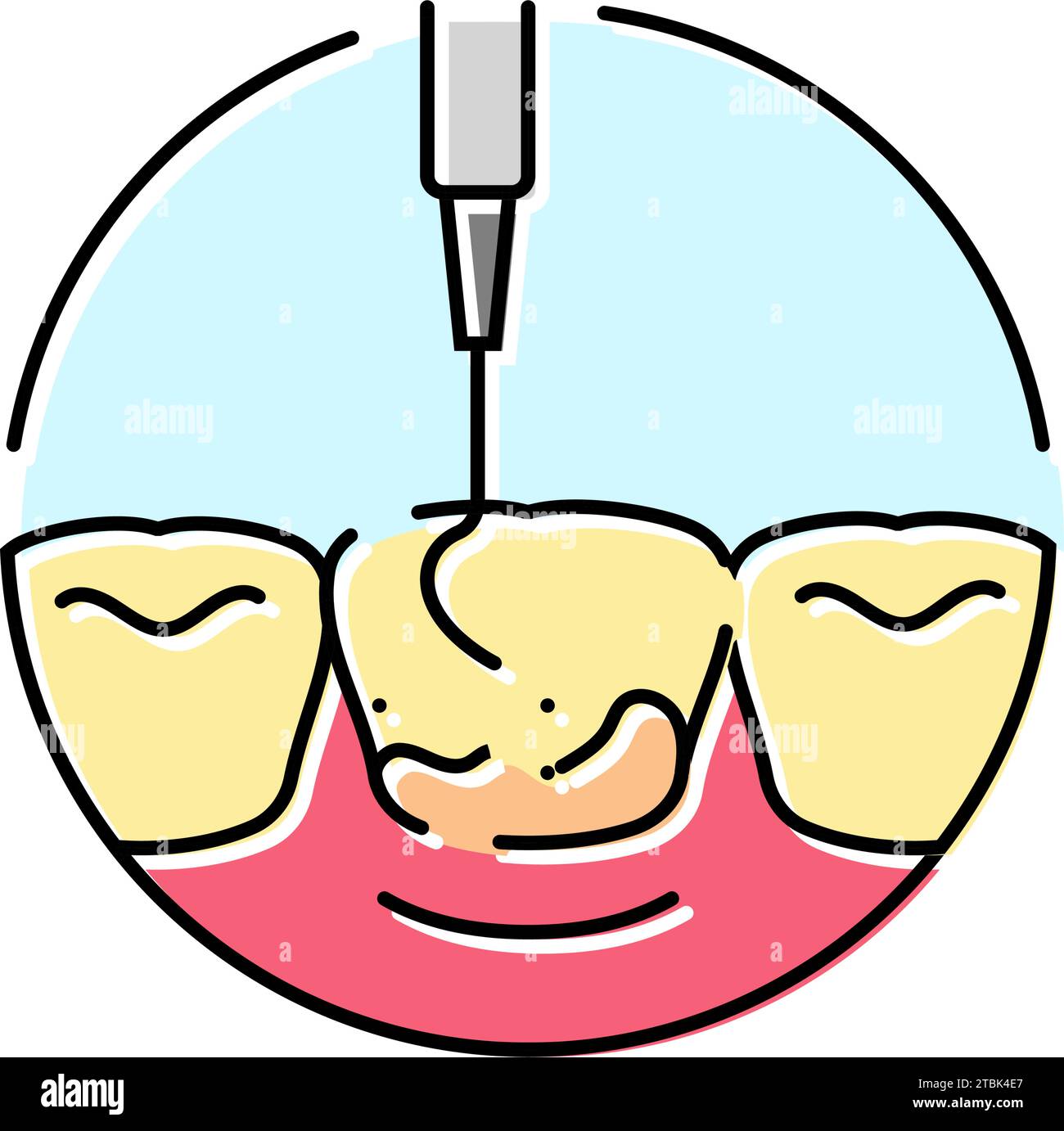 scaling dental procedure color icon vector illustration Stock Vector ...
