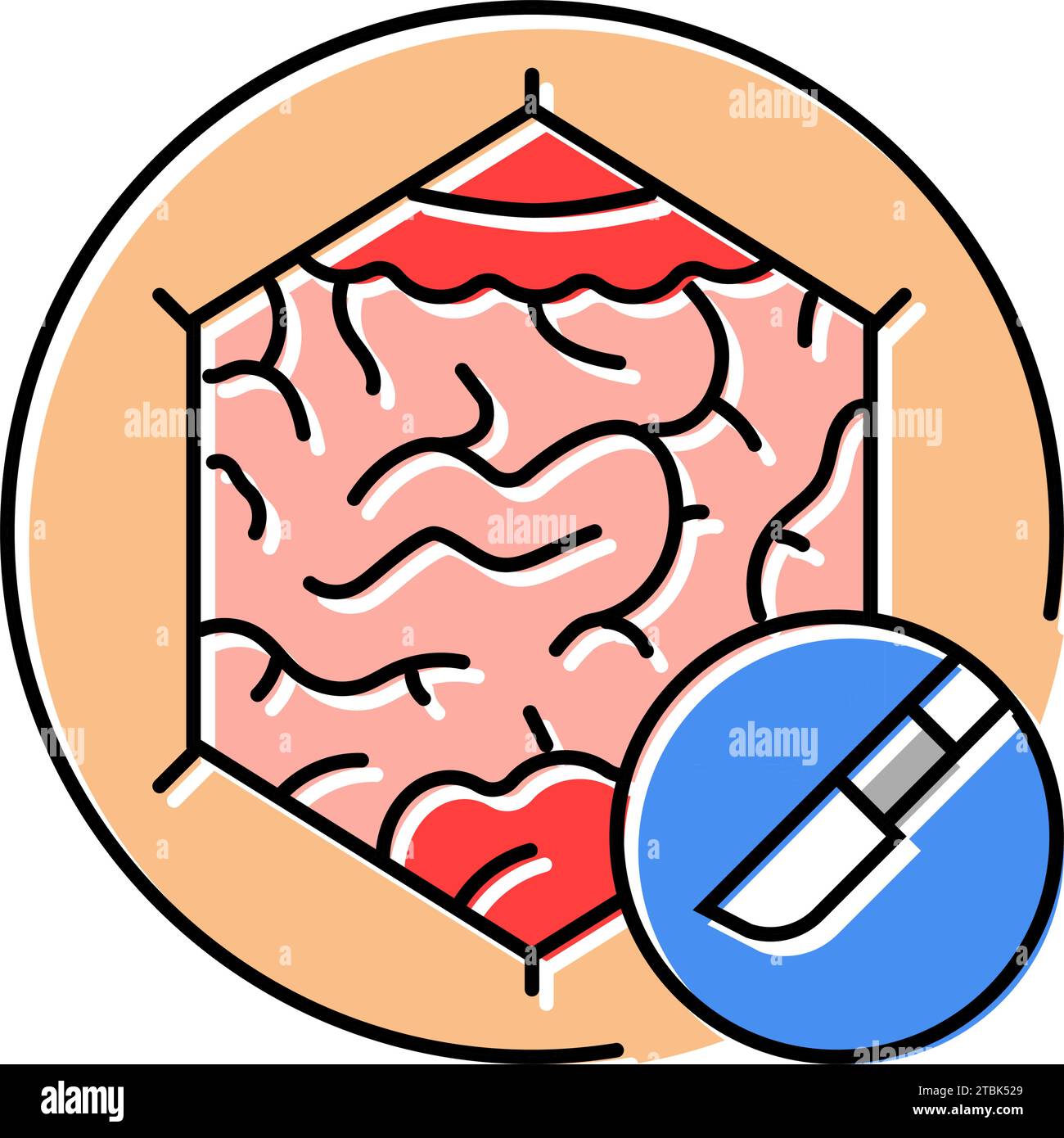 abdominal surgery color icon vector illustration Stock Vector Image ...