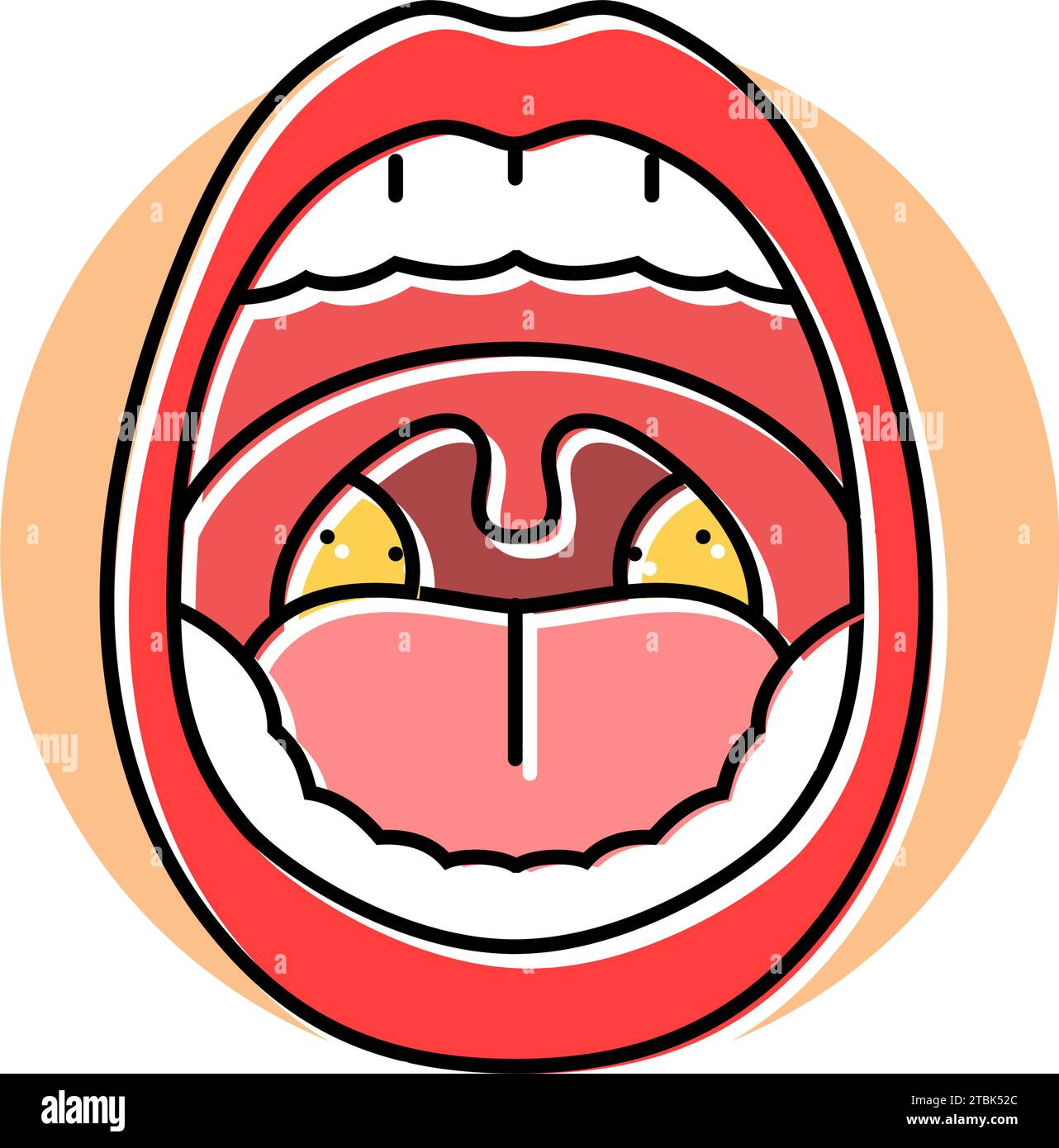 swollen tonsils disease symptom color icon vector illustration Stock ...