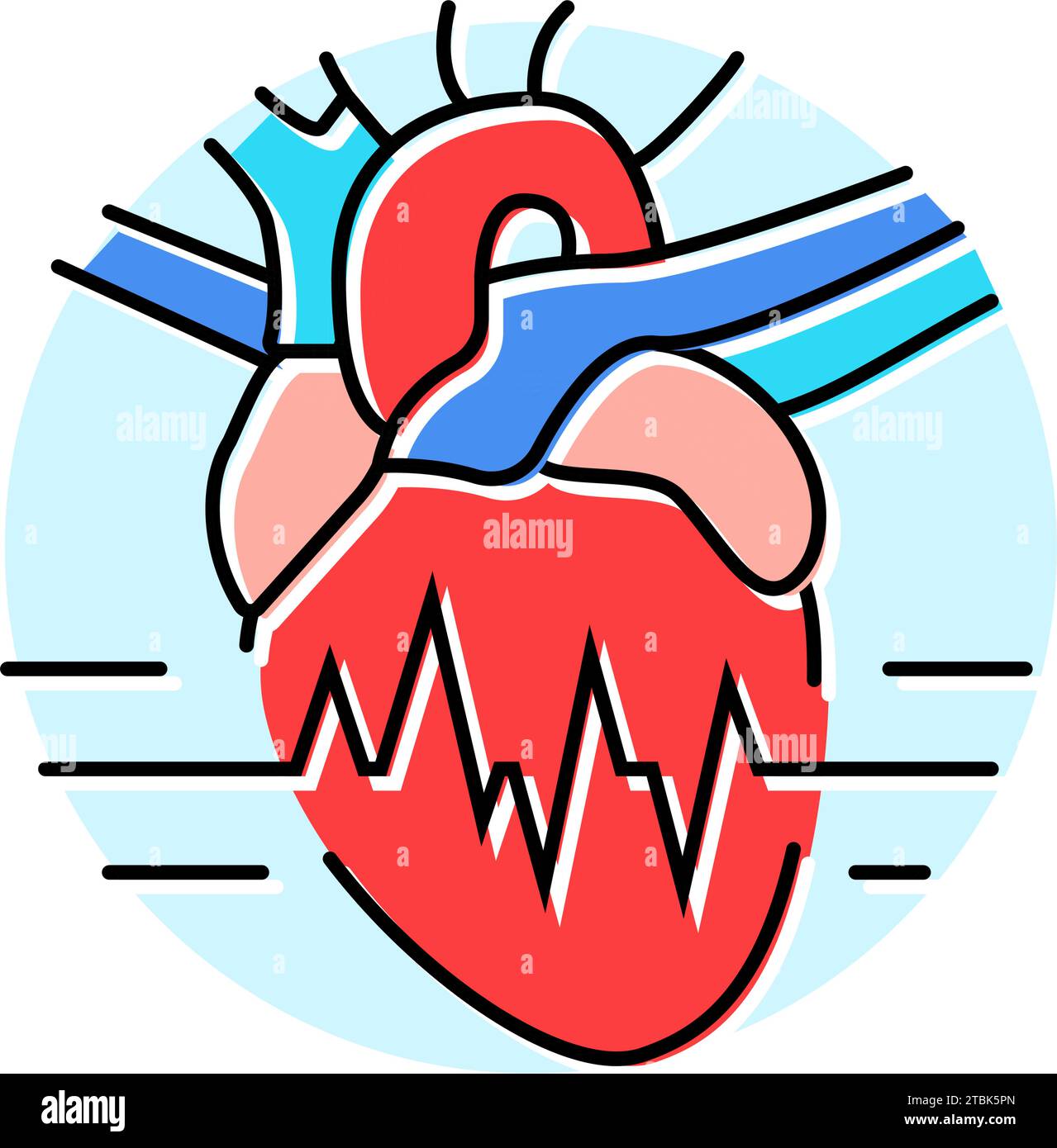 swollen abdomen disease symptom color icon vector illustration Stock ...