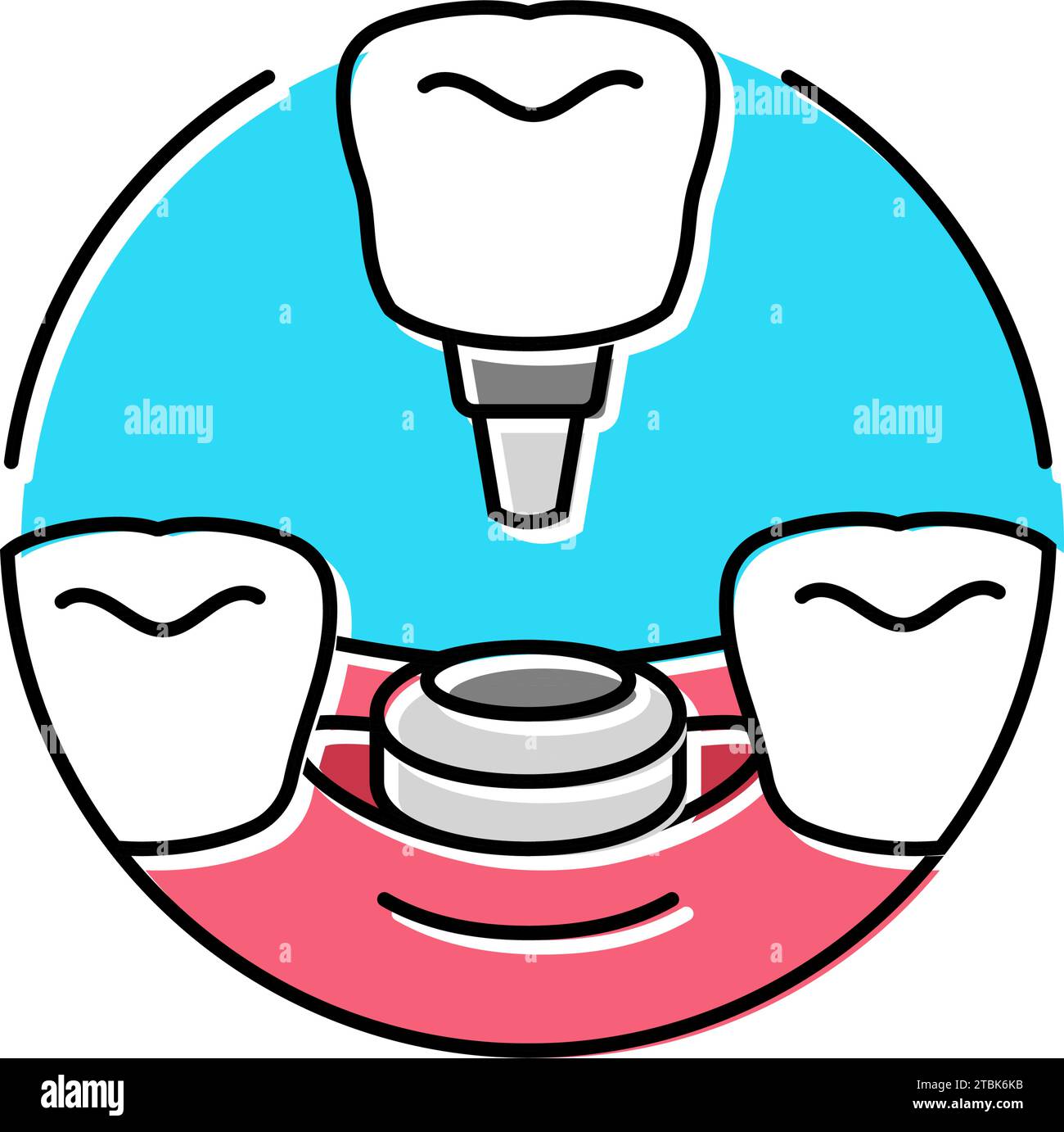 implant dental procedure color icon vector illustration Stock Vector ...