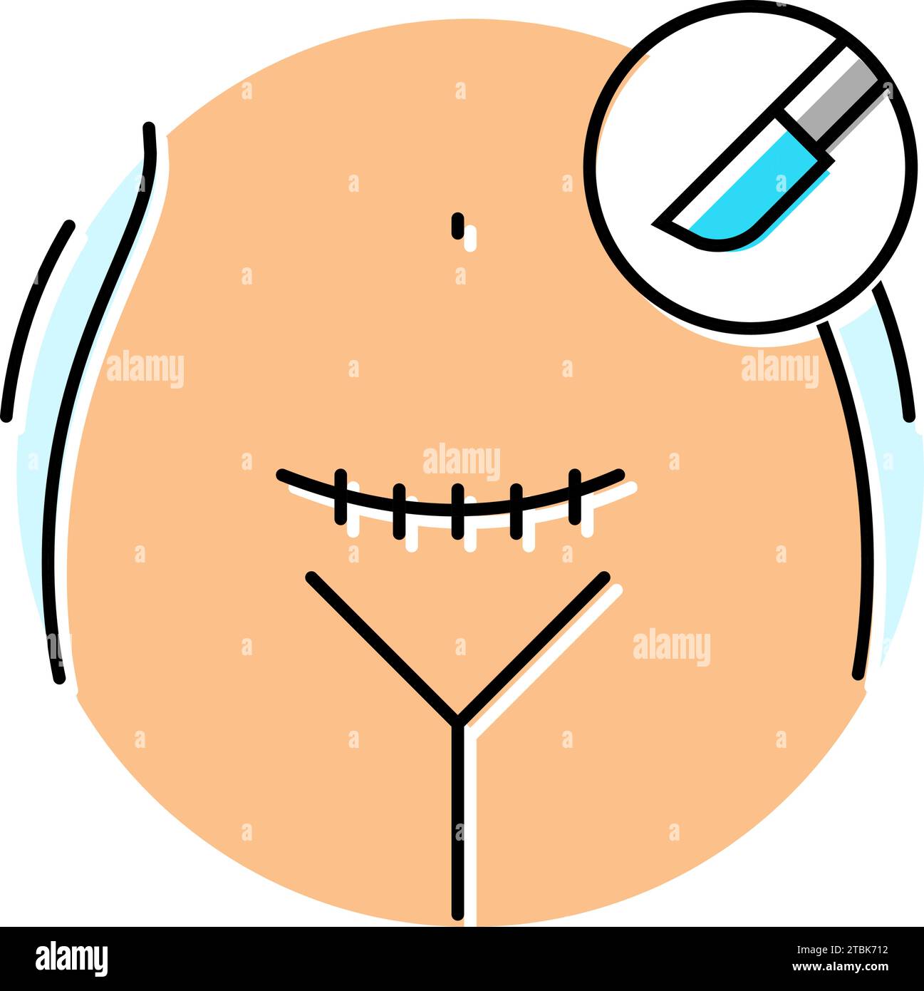 cesarean section gynecologist color icon vector illustration Stock Vector Image & Art - Alamy