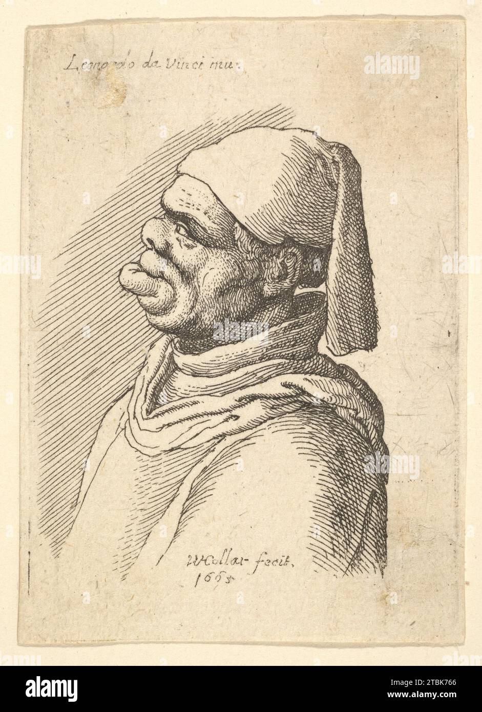 Bust of a deformed man with a hat and a fat, protruding lower lip in ...