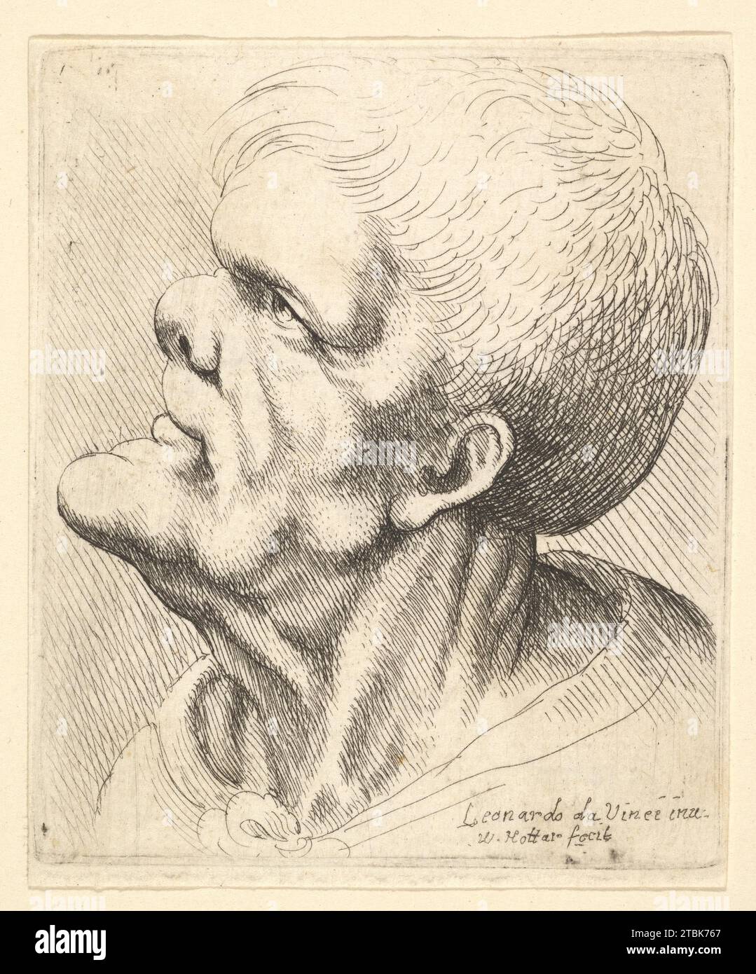 Head of a man with protruding chin and snub nose looking upwards in ...