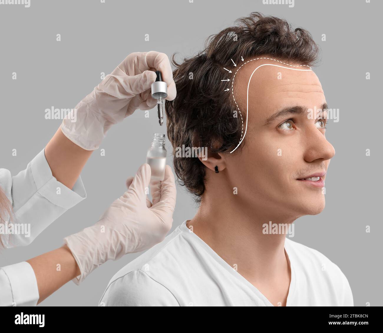 Young man undergoing serum treatment for hair growth on grey background ...