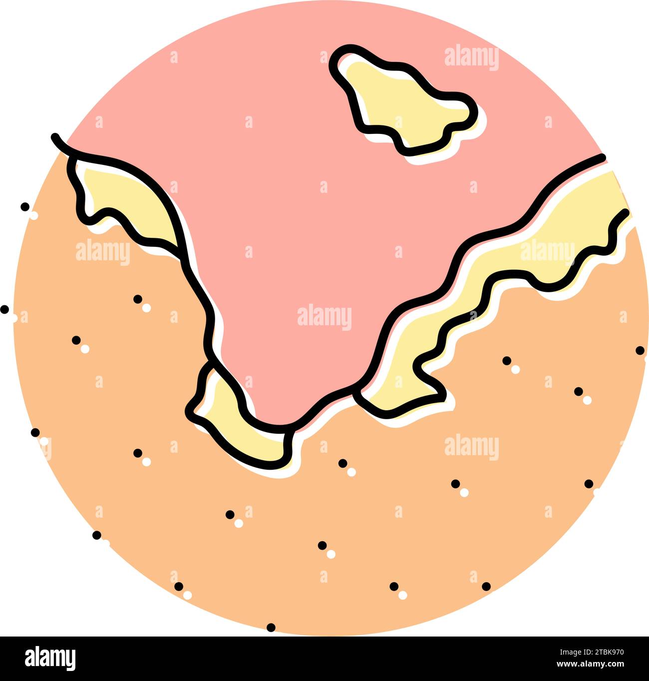 skin peeling flaking disease symptom color icon vector illustration ...