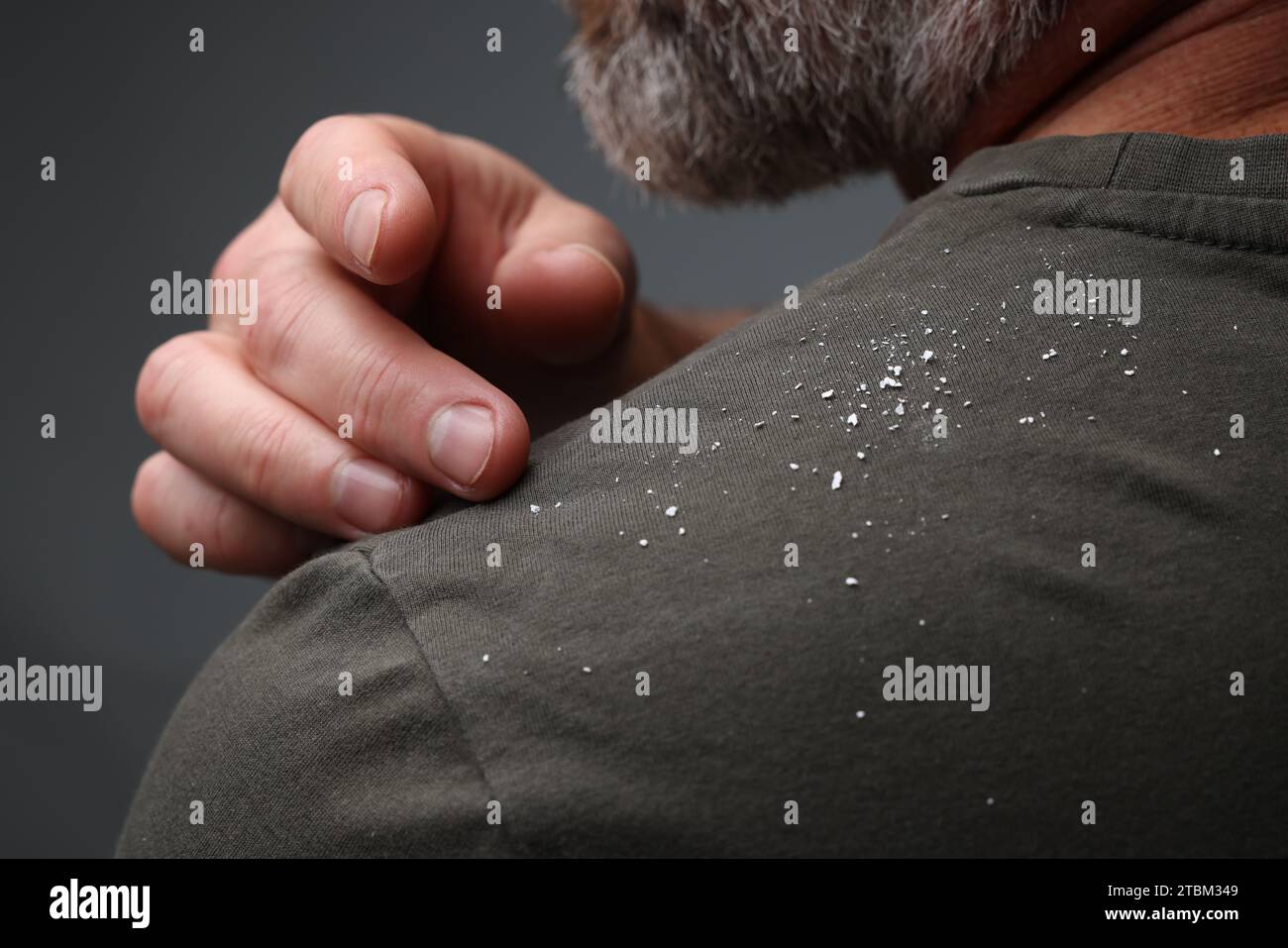 Bearded man brushing dandruff off his t-shirt on grey background ...