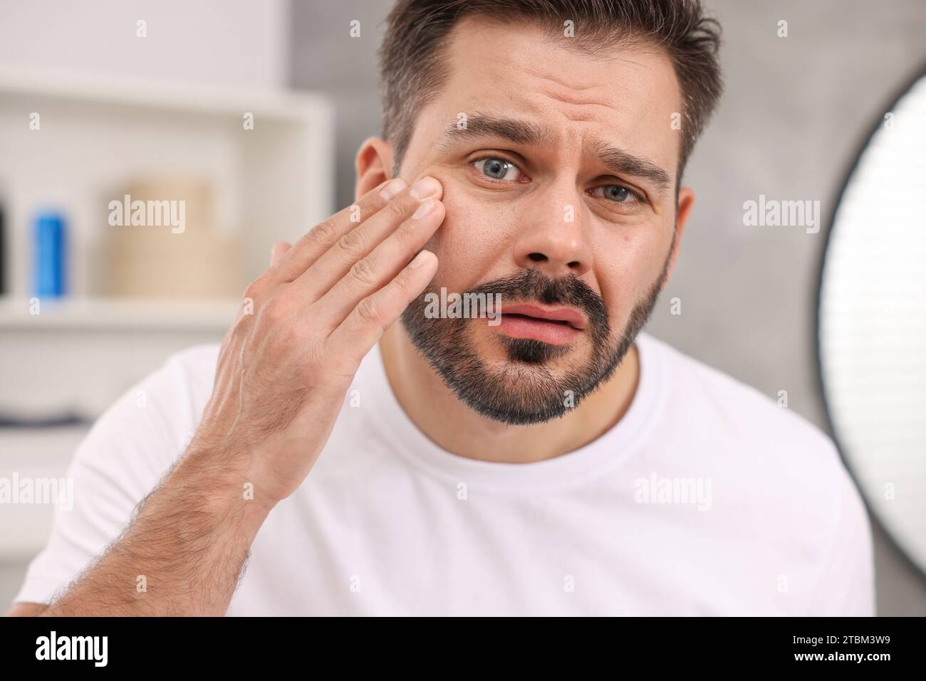 Skin problem. Confused man touching his face at home Stock Photo - Alamy