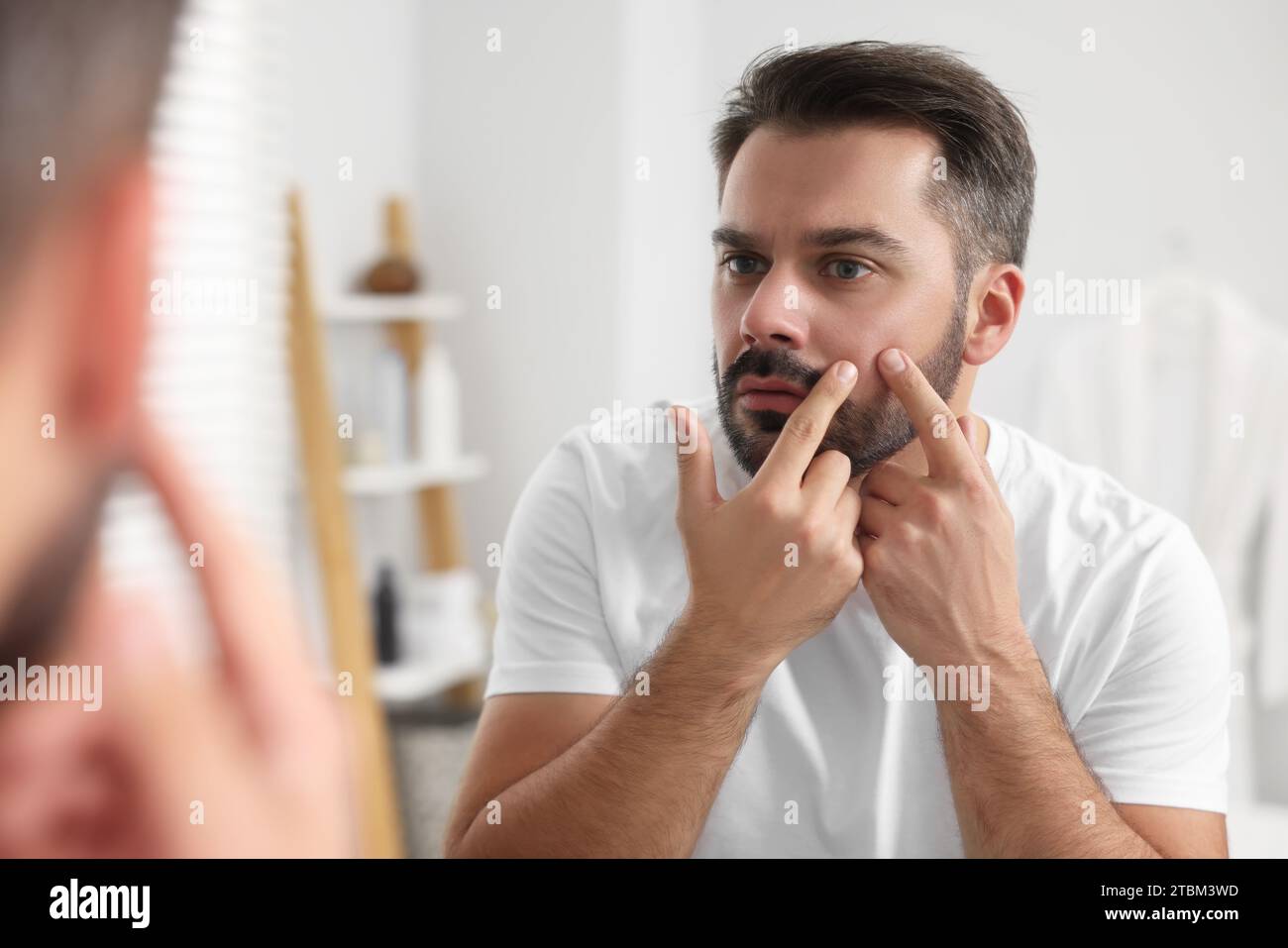 Confused man with skin problem looking at mirror indoors Stock Photo ...