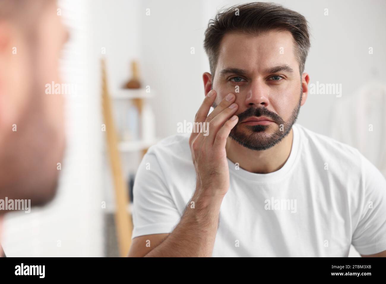 Confused man with skin problem looking at mirror indoors Stock Photo ...