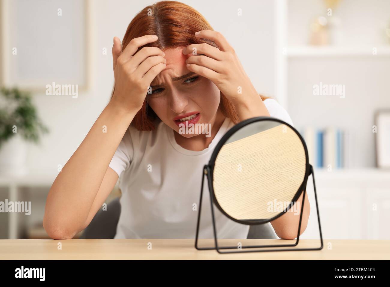 Woman face allergy eczema hi-res stock photography and images - Alamy