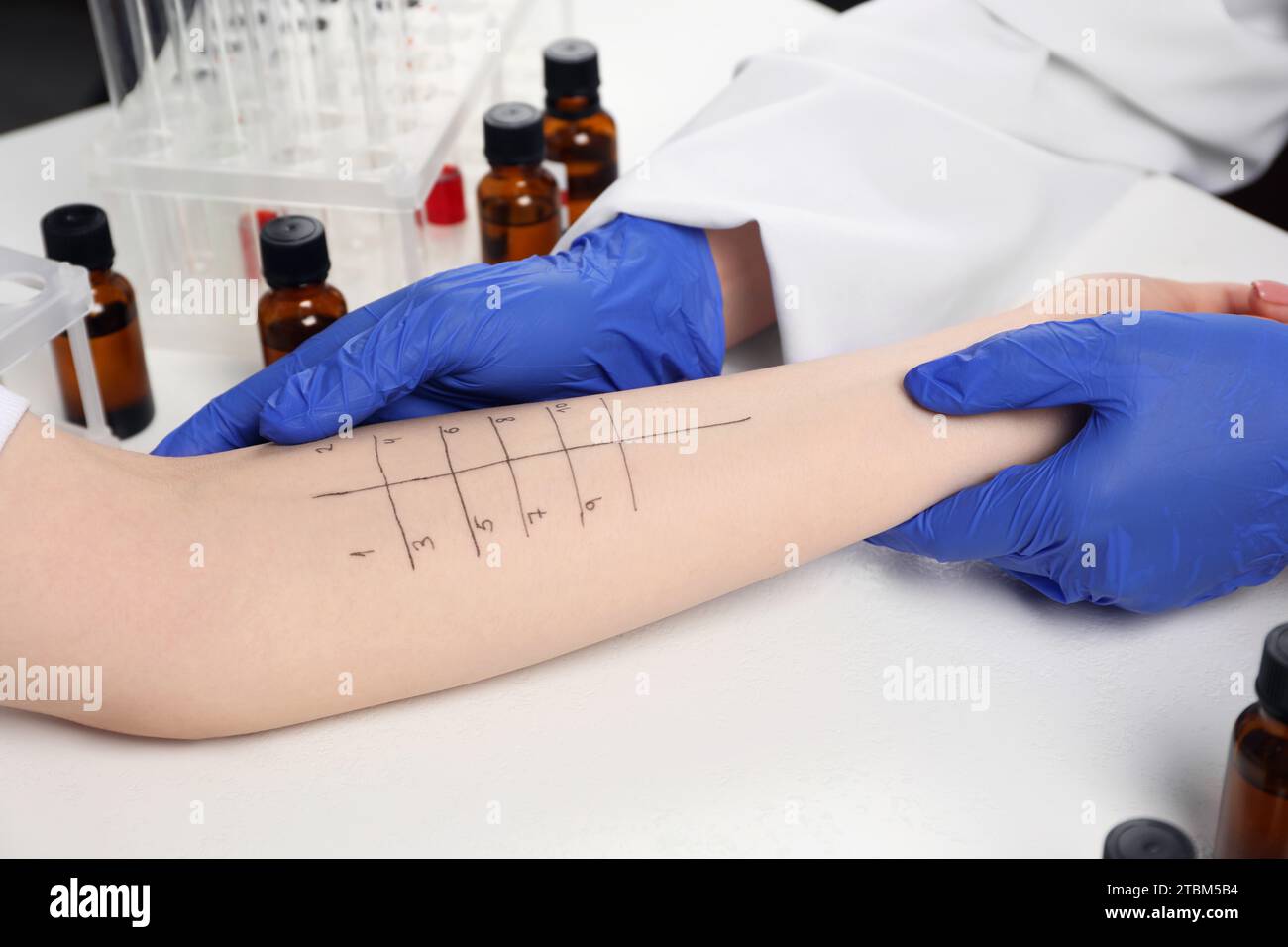 Doctor doing skin allergy test at light table, closeup Stock Photo - Alamy