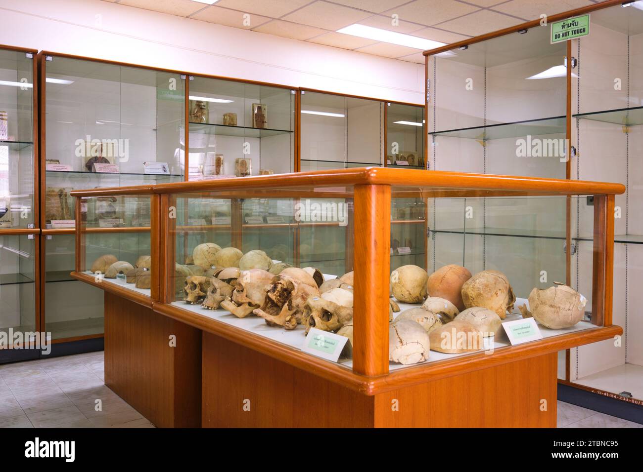 A case, filled with human skulls, bones. At the Ellis Pathological ...