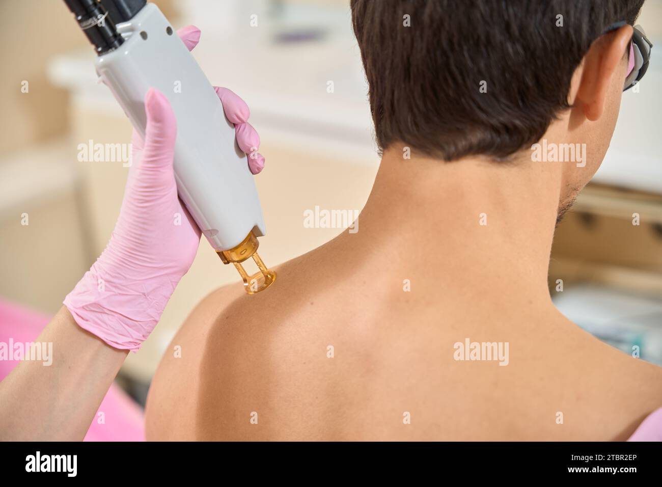 Male at a shoulder laser hair removal session Stock Photo - Alamy