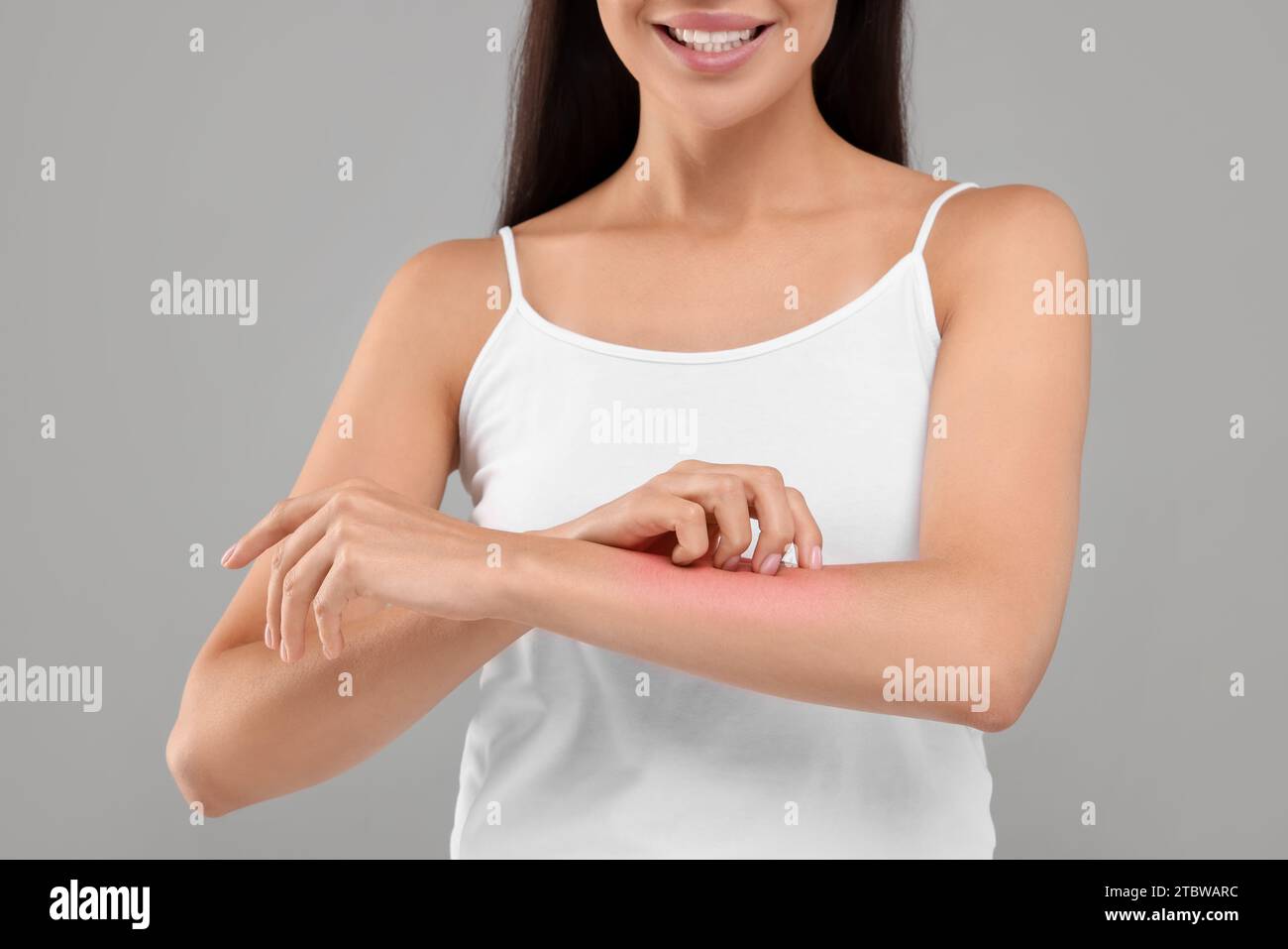 Young woman scratching her arm on light grey background, closeup Stock ...