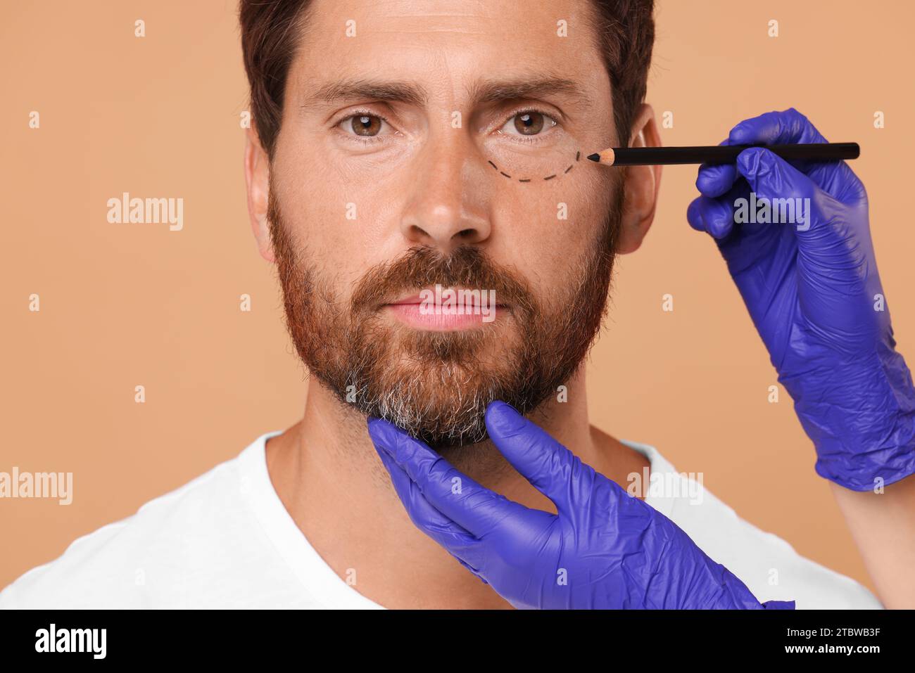 Doctor drawing marks on man's face for cosmetic surgery operation ...