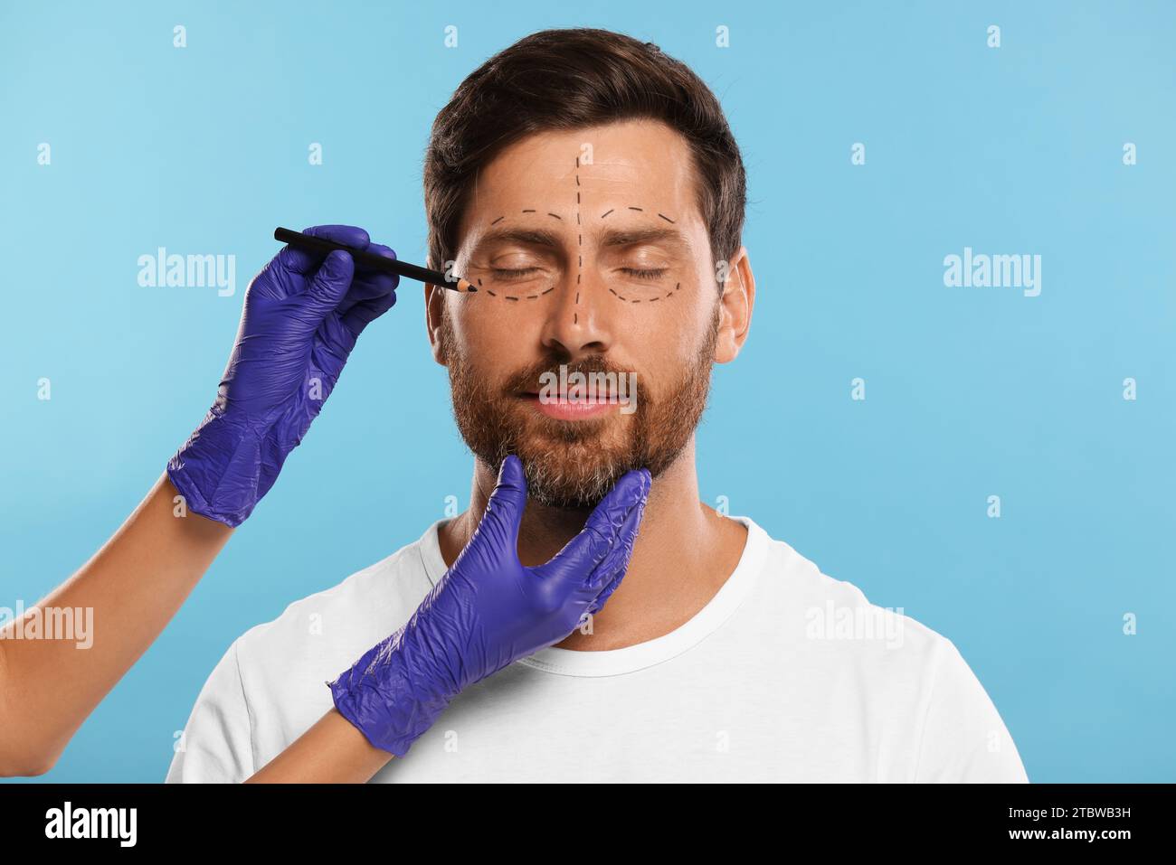 Doctor drawing marks on man's face for cosmetic surgery operation ...