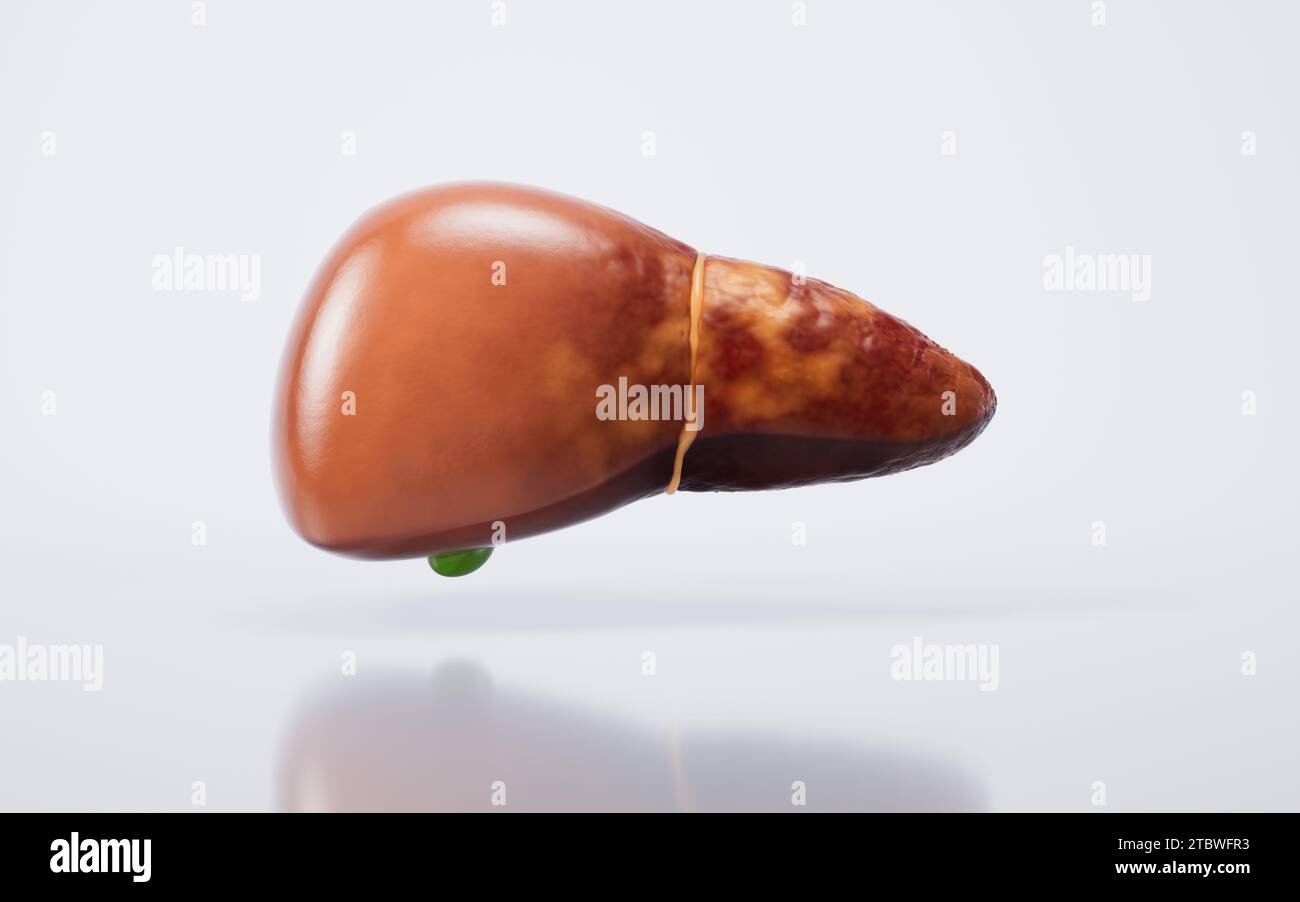Liver organ with fatty liver state, 3d rendering. 3D illustration Stock ...