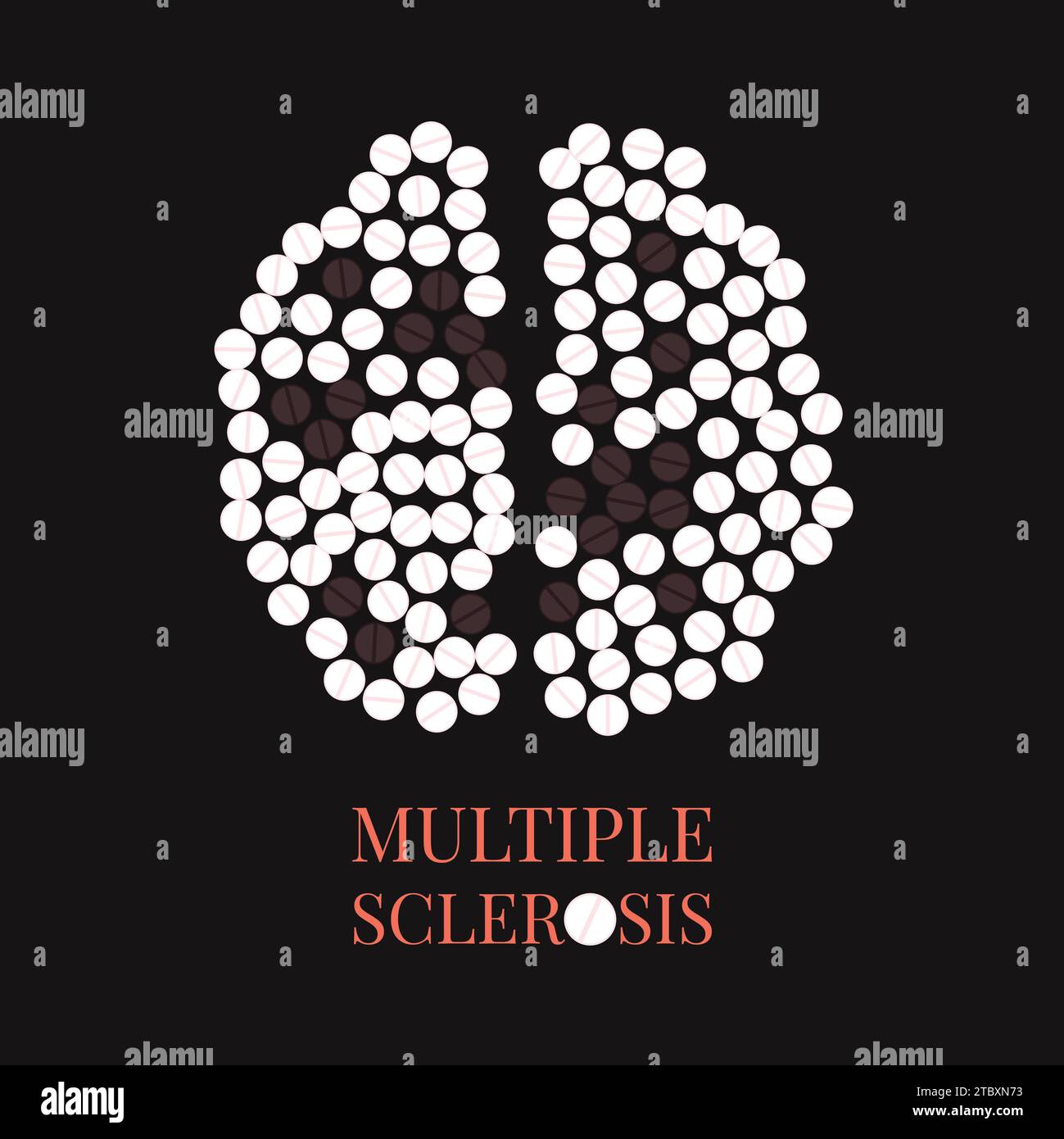 Multiple sclerosis diagram hi-res stock photography and images - Alamy