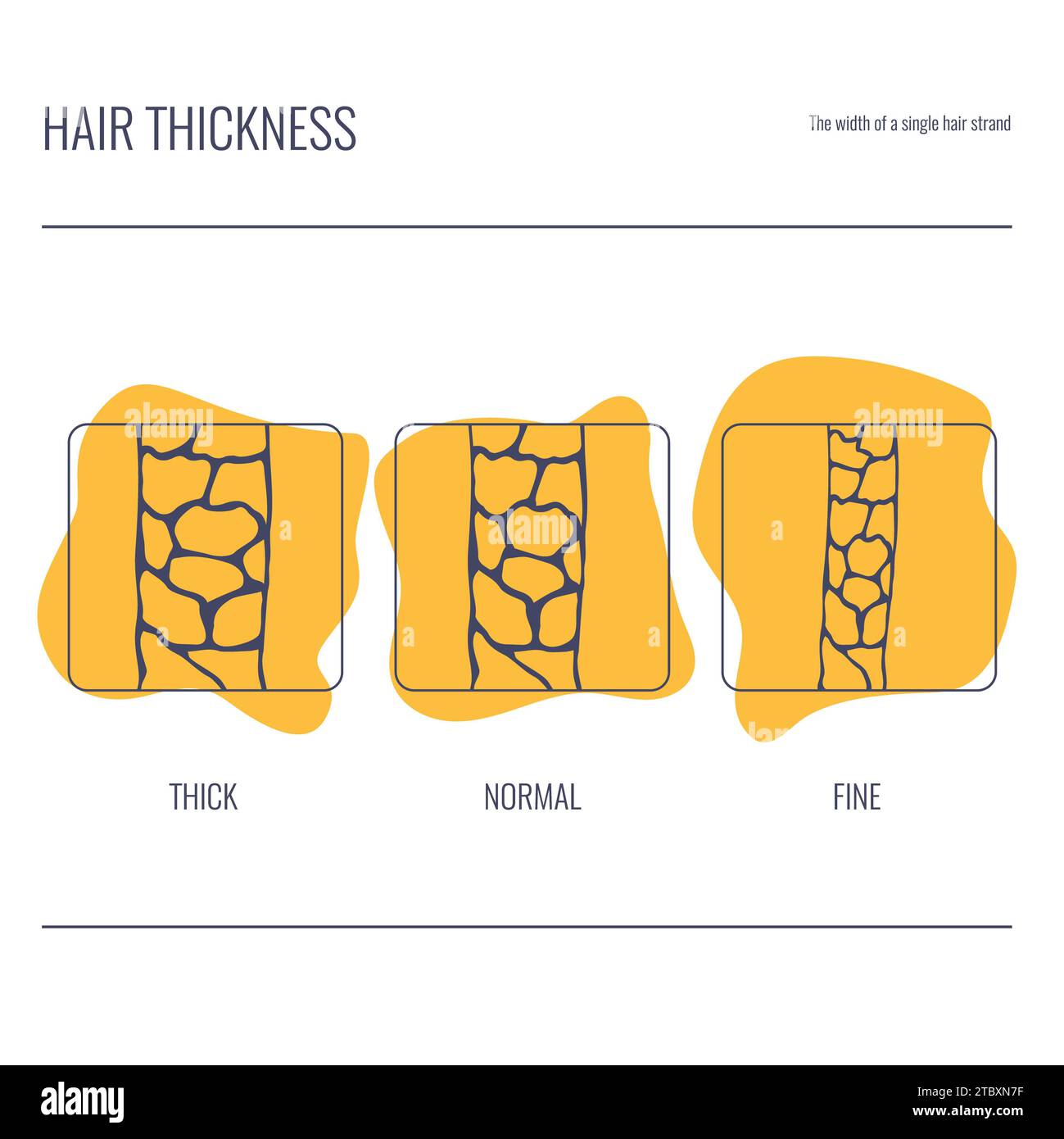 Hair density, conceptual illustration Stock Photo - Alamy Hair density, conceptual illustration Stock Photo - Alamy