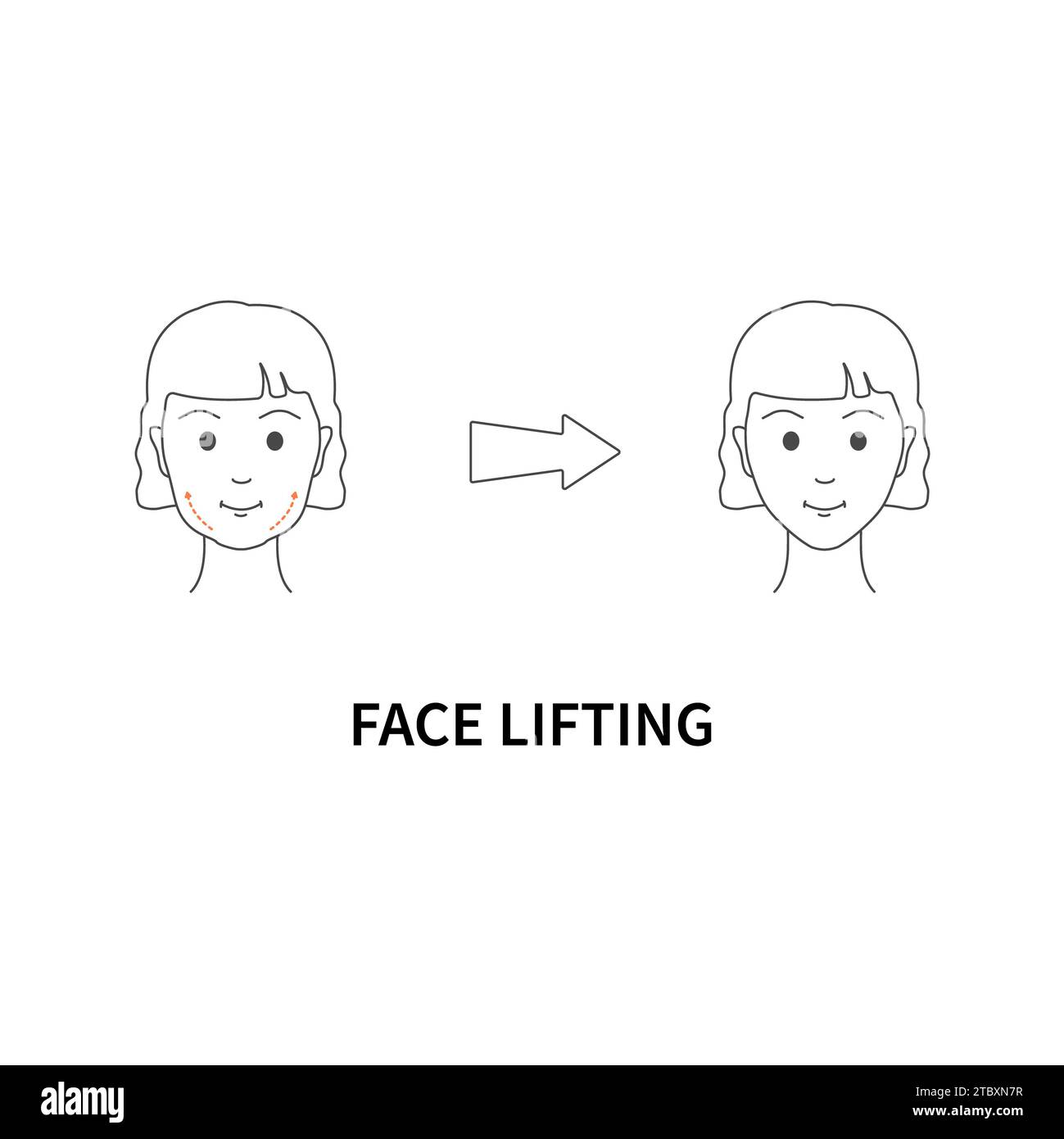 Facelifting, conceptual illustration Stock Photo - Alamy