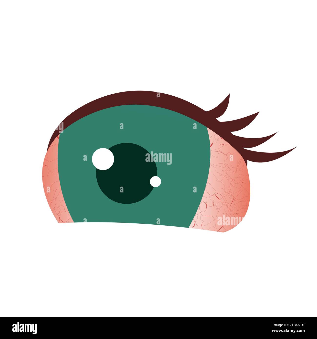 Conjunctivitis, conceptual illustration Stock Photo - Alamy