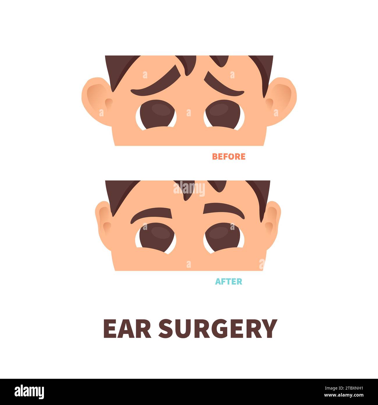 Ear surgery, conceptual illustration Stock Photo - Alamy