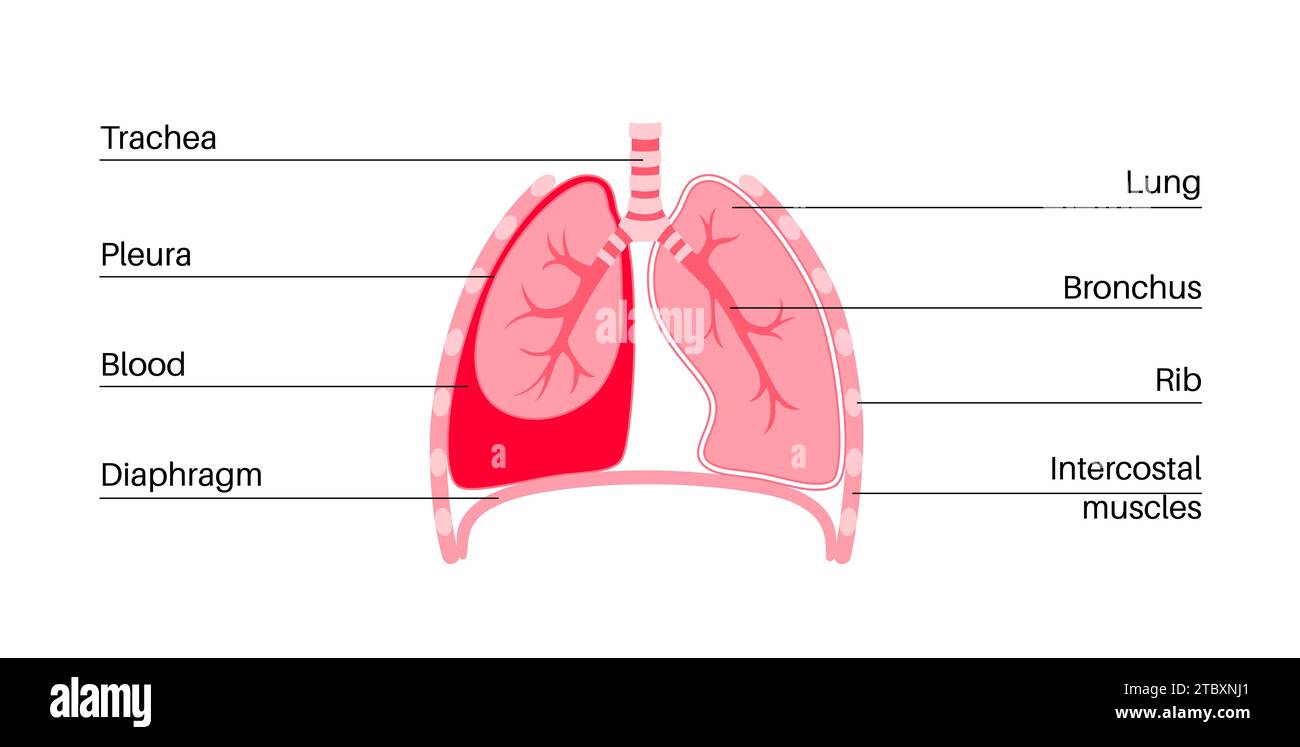 Haemothorax hi-res stock photography and images - Alamy