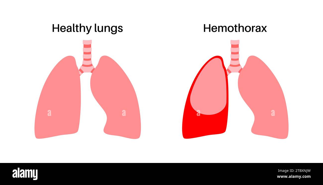 Inhale exhale diagram Cut Out Stock Images & Pictures - Alamy