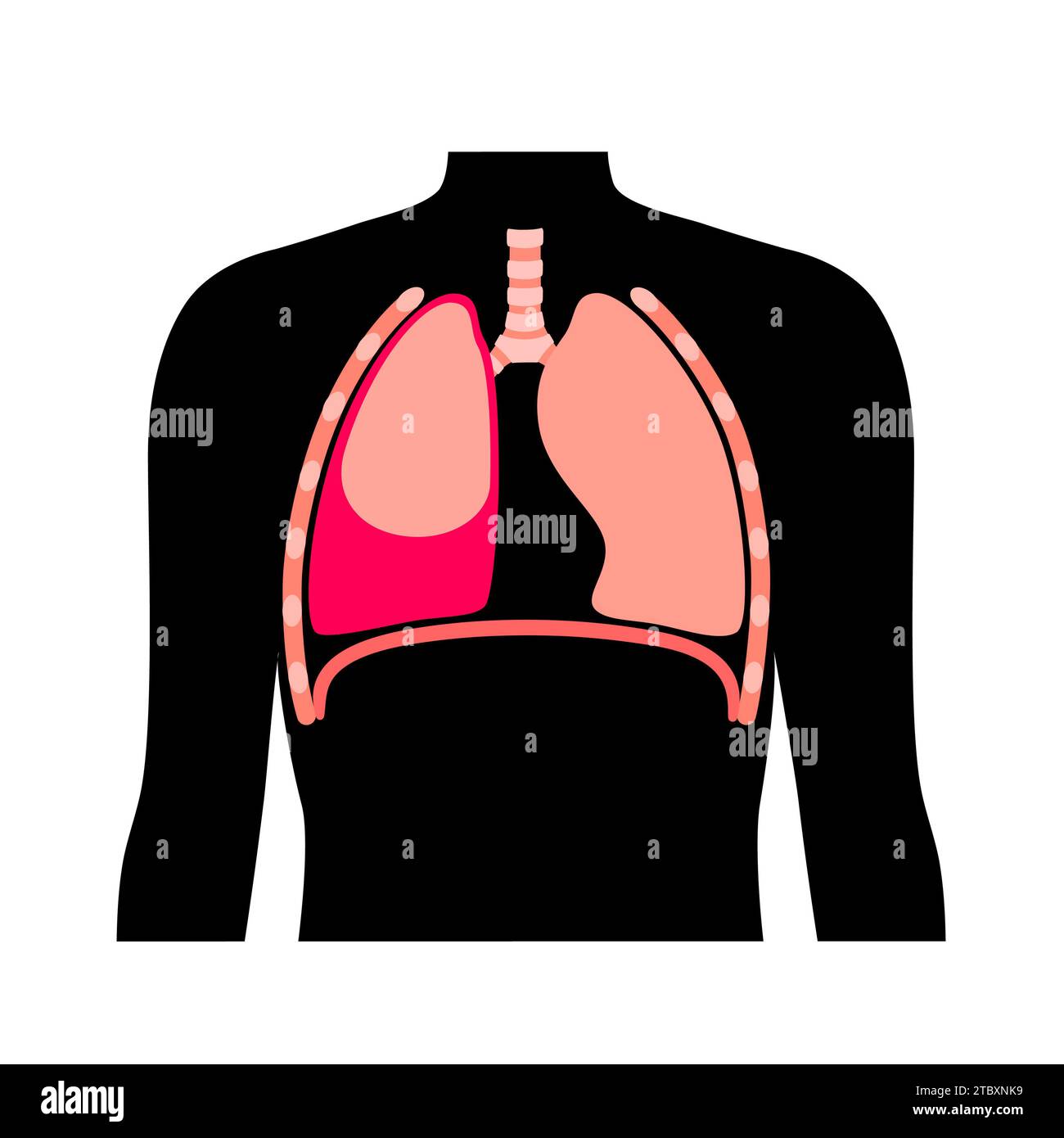 Haemothorax hi-res stock photography and images - Alamy