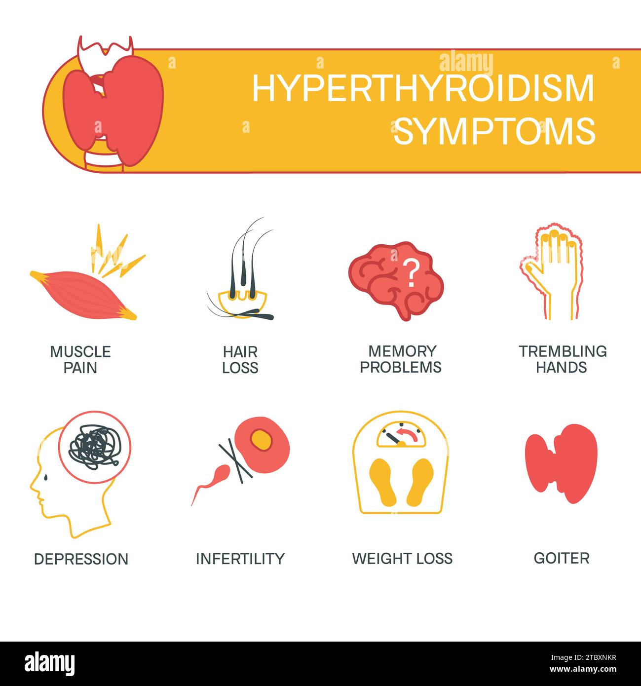 Hyperthyroidism, conceptual illustration Stock Photo - Alamy