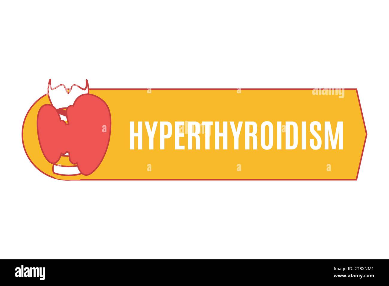 Hyperthyroidism, conceptual illustration Stock Photo - Alamy