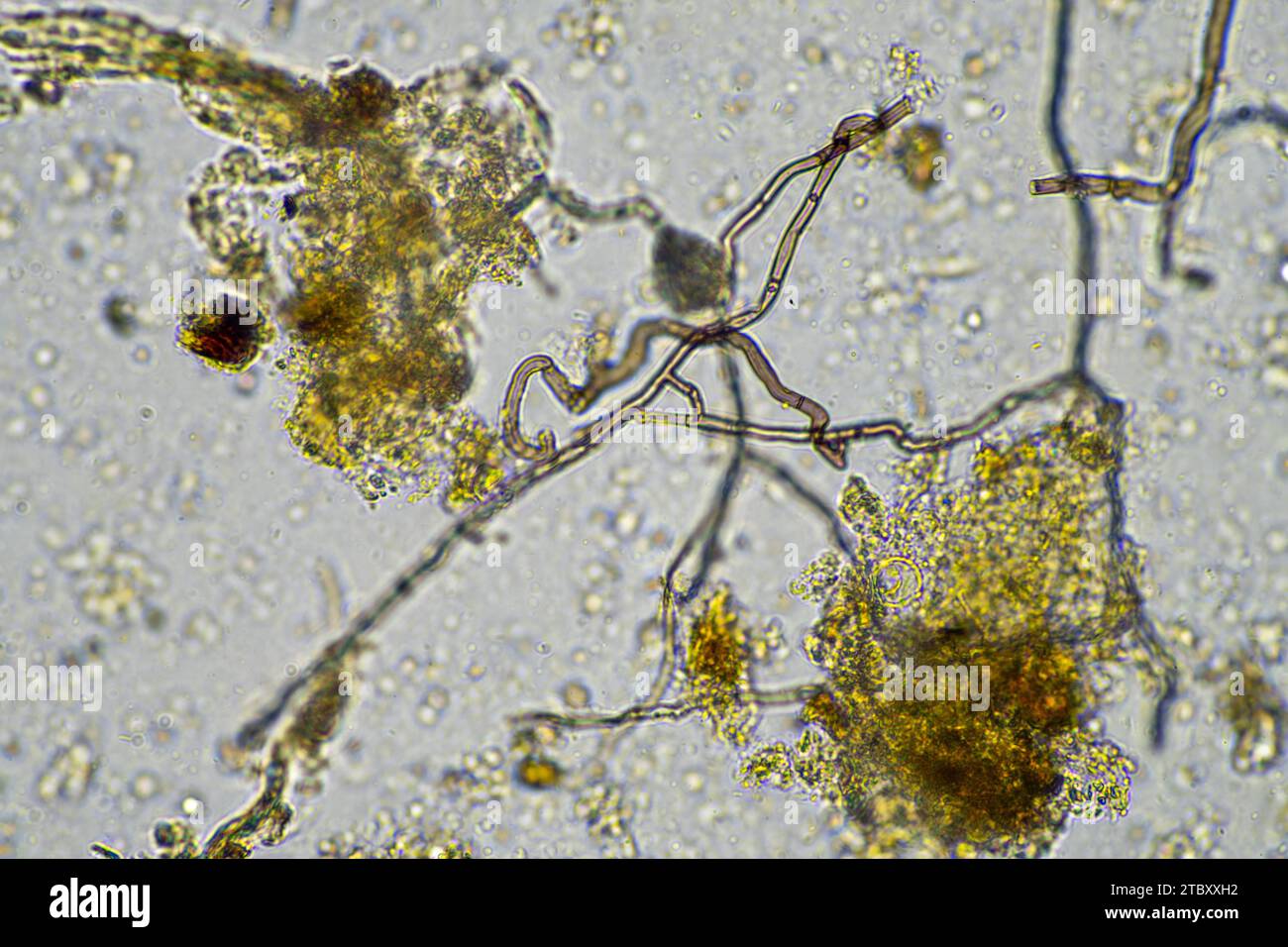 soil microbes under the microscope. microorganisms with fungus in ...