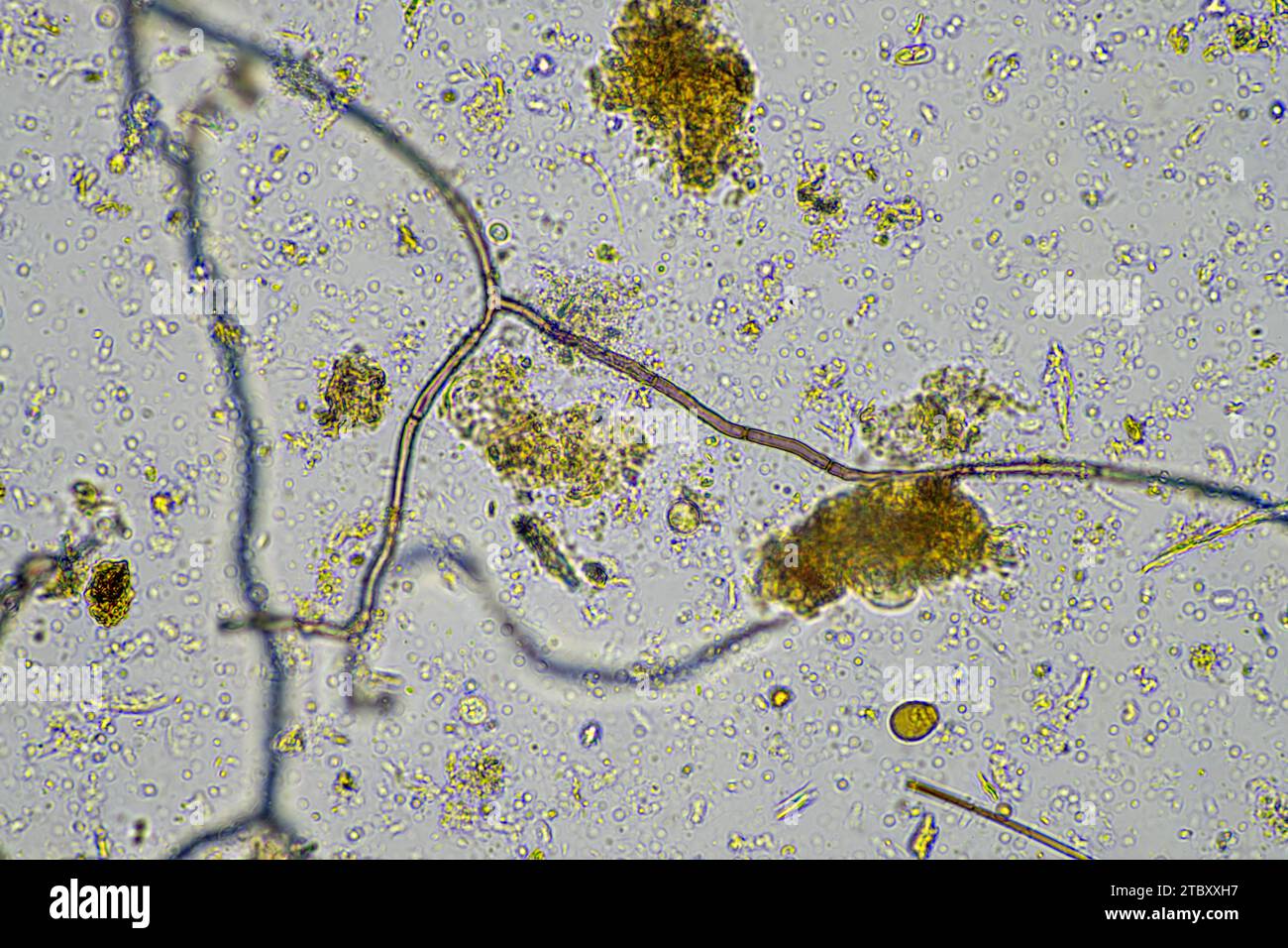 microscopic microorganisms under the microscope Stock Photo - Alamy